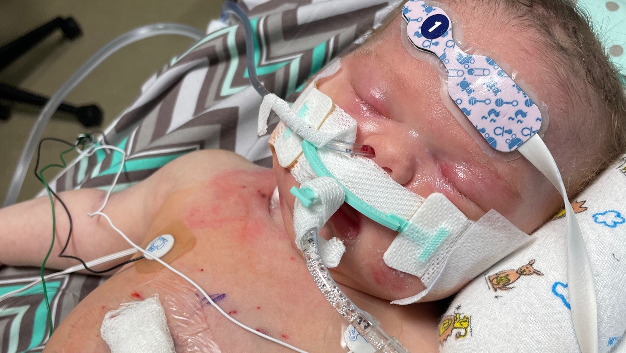 Fundraiser for Amy Gallagher by Jennifer McCubbin : Baby Iva Lynn CDH ...