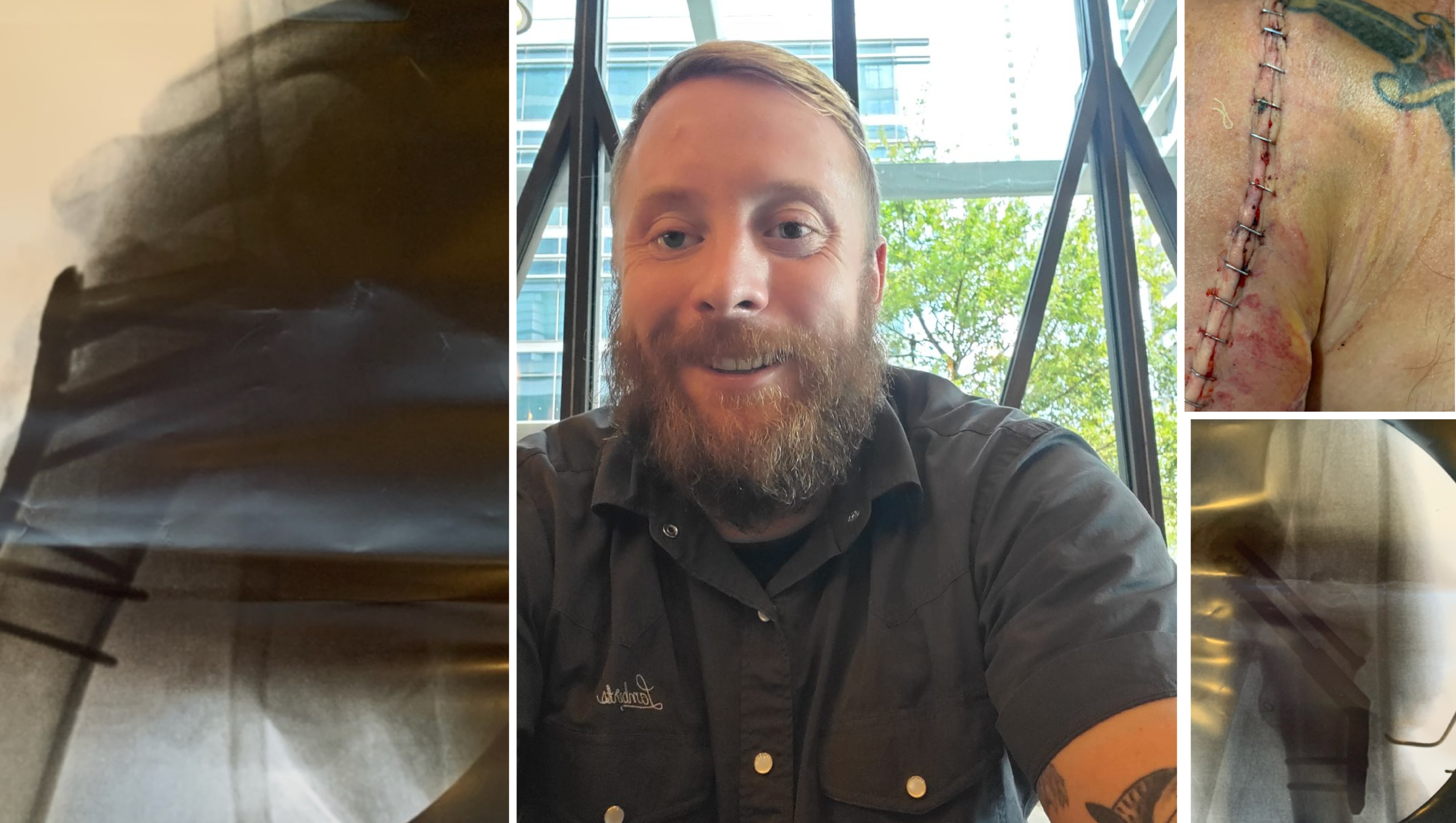 Fundraiser for Christopher Hall by Gregg Butler : Donate to help ...