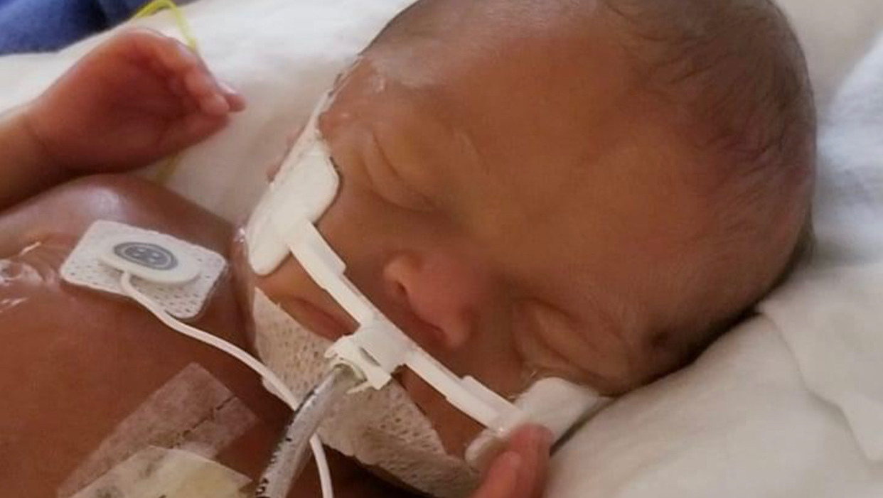 Fundraiser for Cassidy Backus by Phillip Whatley : Baby Oliver's ...