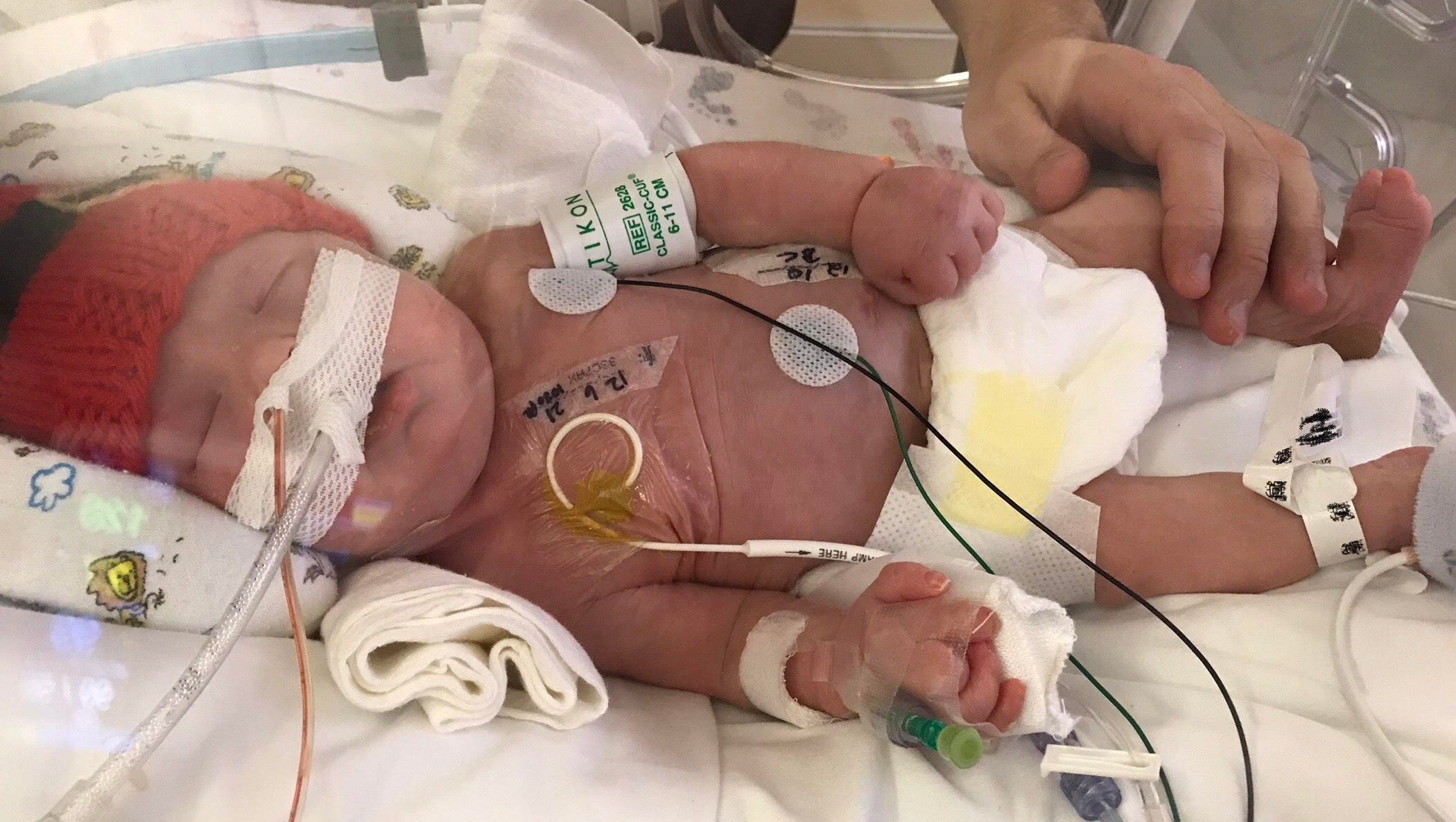 Fundraiser for Judes Dad by D.S. Fiola : Inspiring Baby Jude smiles ...