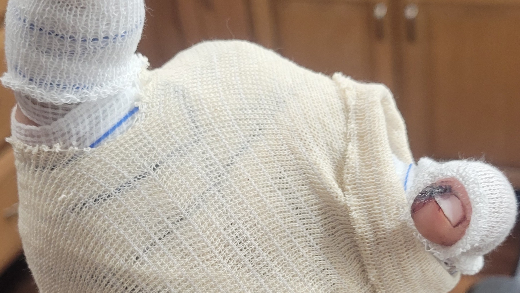 Fundraiser by Joshua Gower : Medical bills