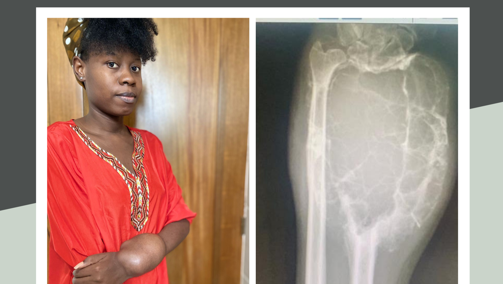 Fundraiser for Ruth CYRIL by Carline Charles : Aidez-moi à retrouver l ...