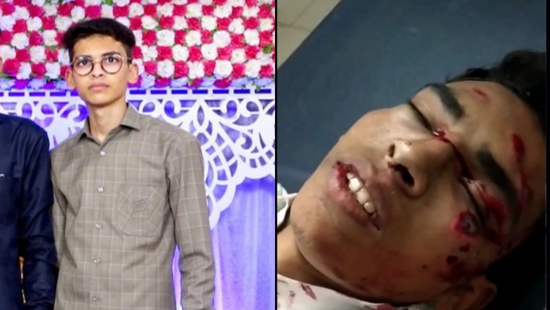 Fundraiser by Ateeq Uddin Mohammed : Support Mirza Abrar for brain and ortho surgery