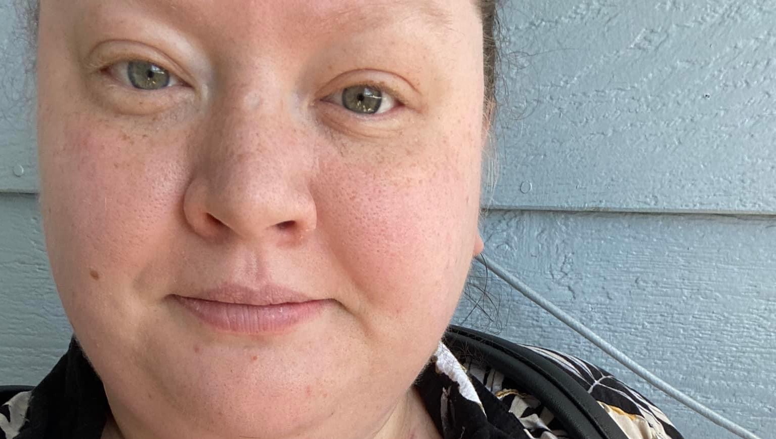 Fundraiser for Amy Mashburn-Frint by Haley Richards : Amy with medical ...