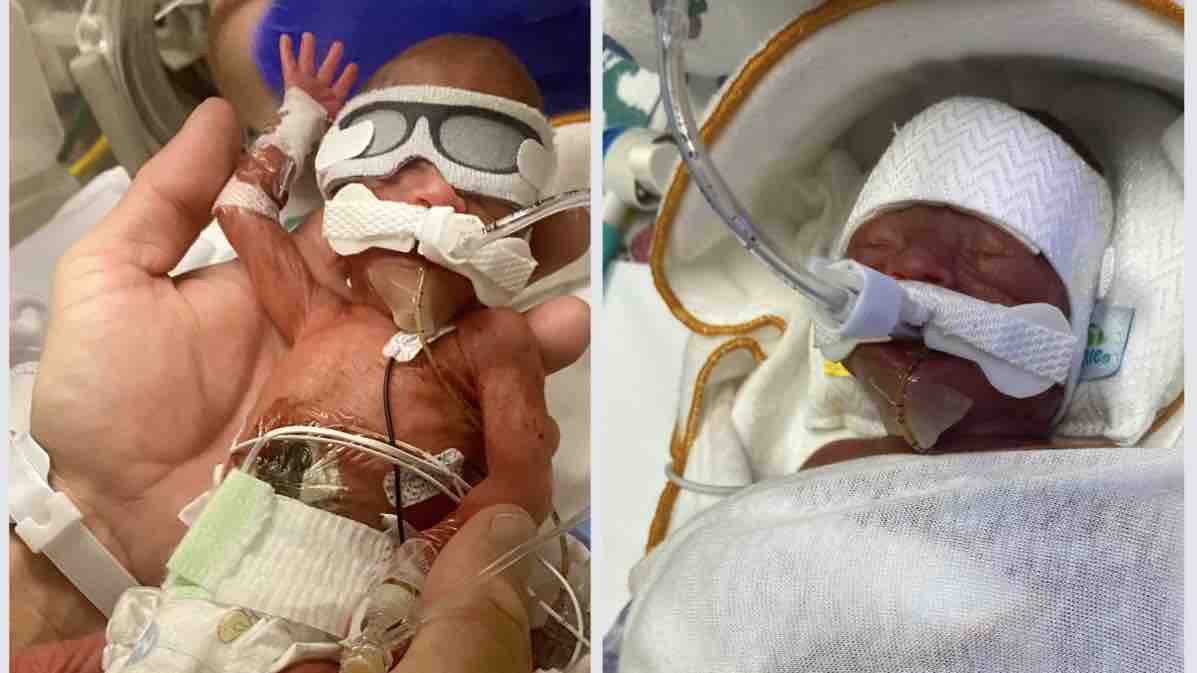 Fundraiser for Brian Rogers by Julie Rogan : Micro-preemies Maximus ...