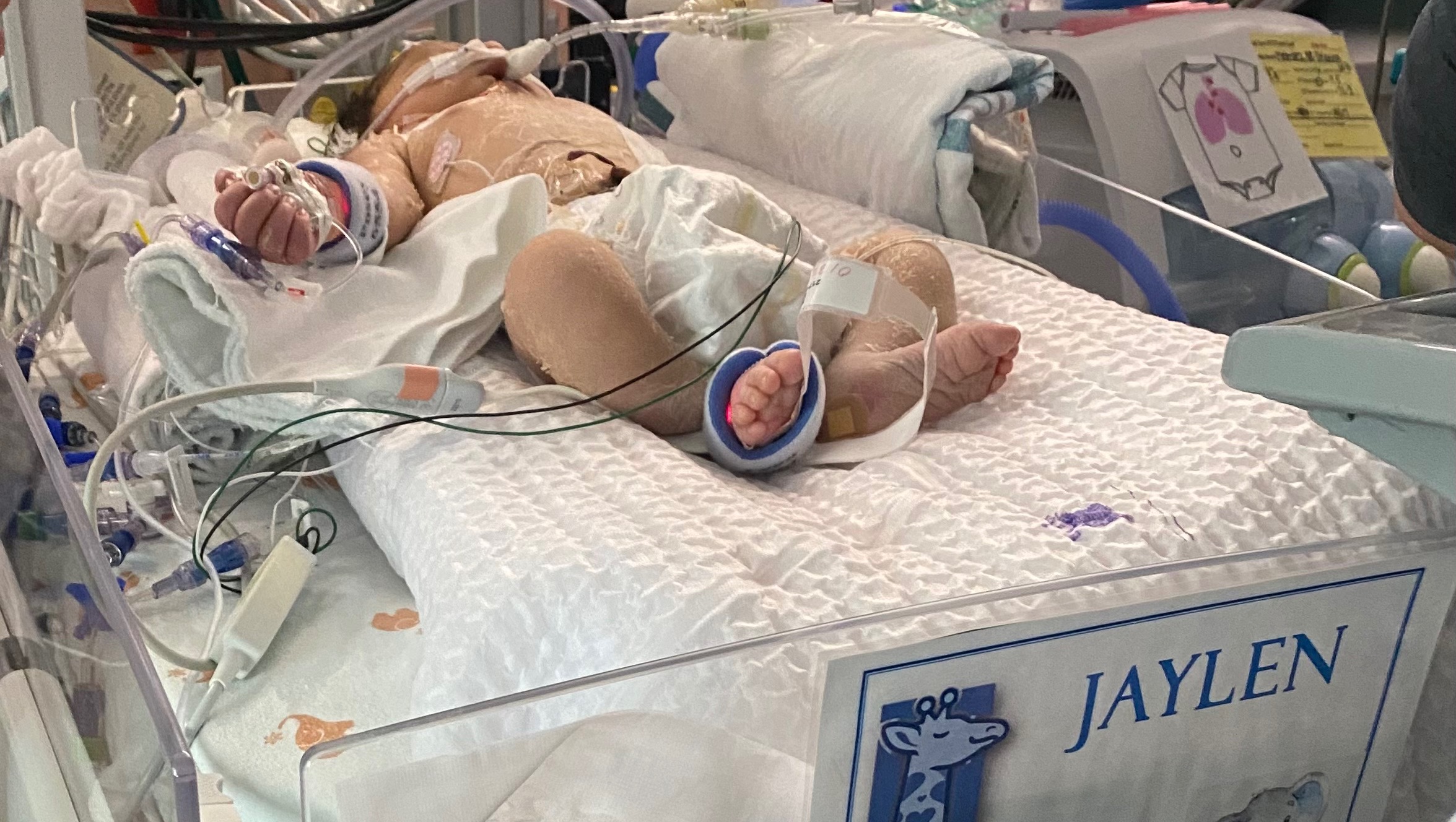 Fundraiser for Drianna Melendez by Delilah Melendez : Baby Jaylen ...