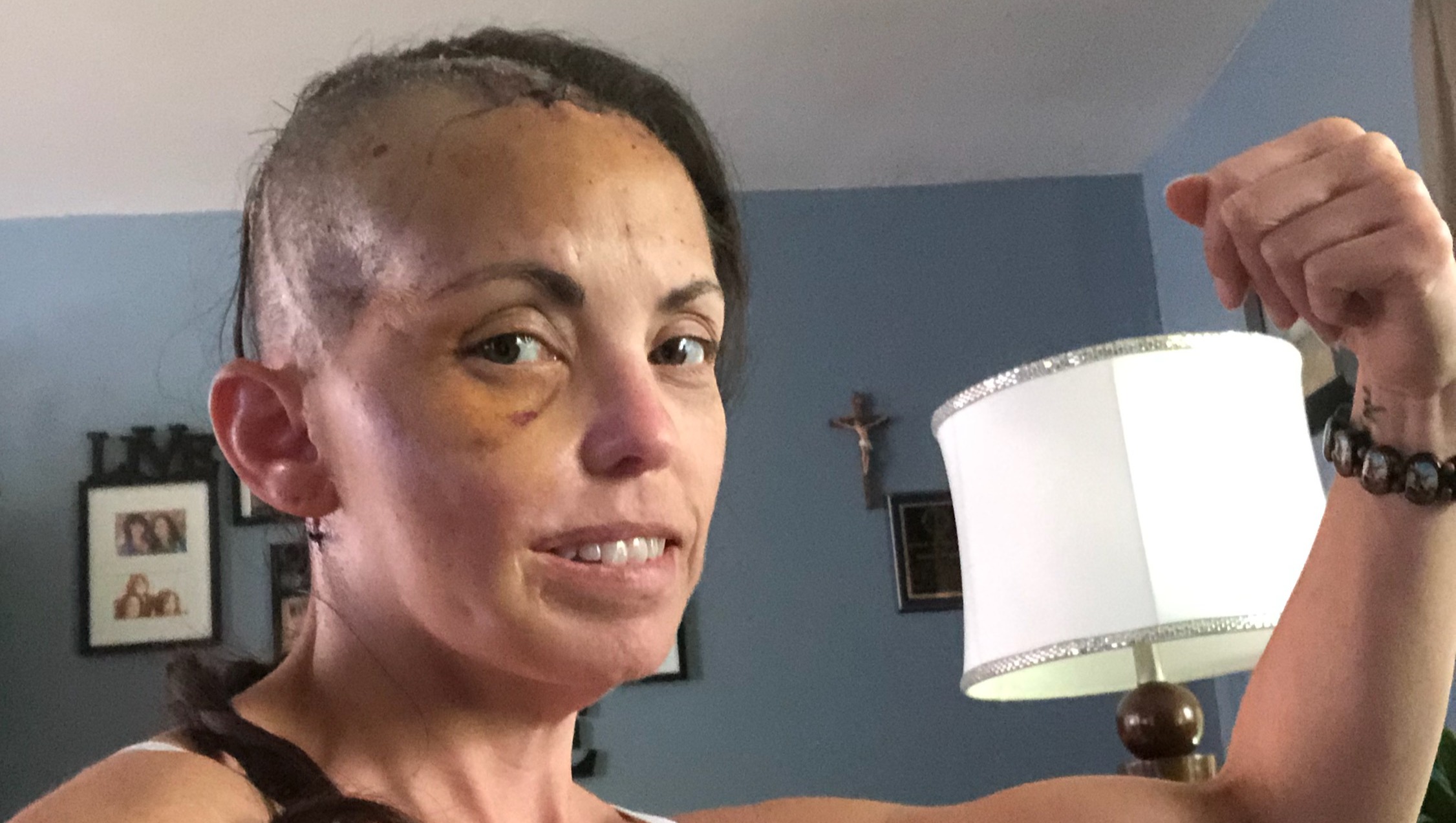 Fundraiser for Jessica Porter by Christina Parra : Jessica's Cranial ...