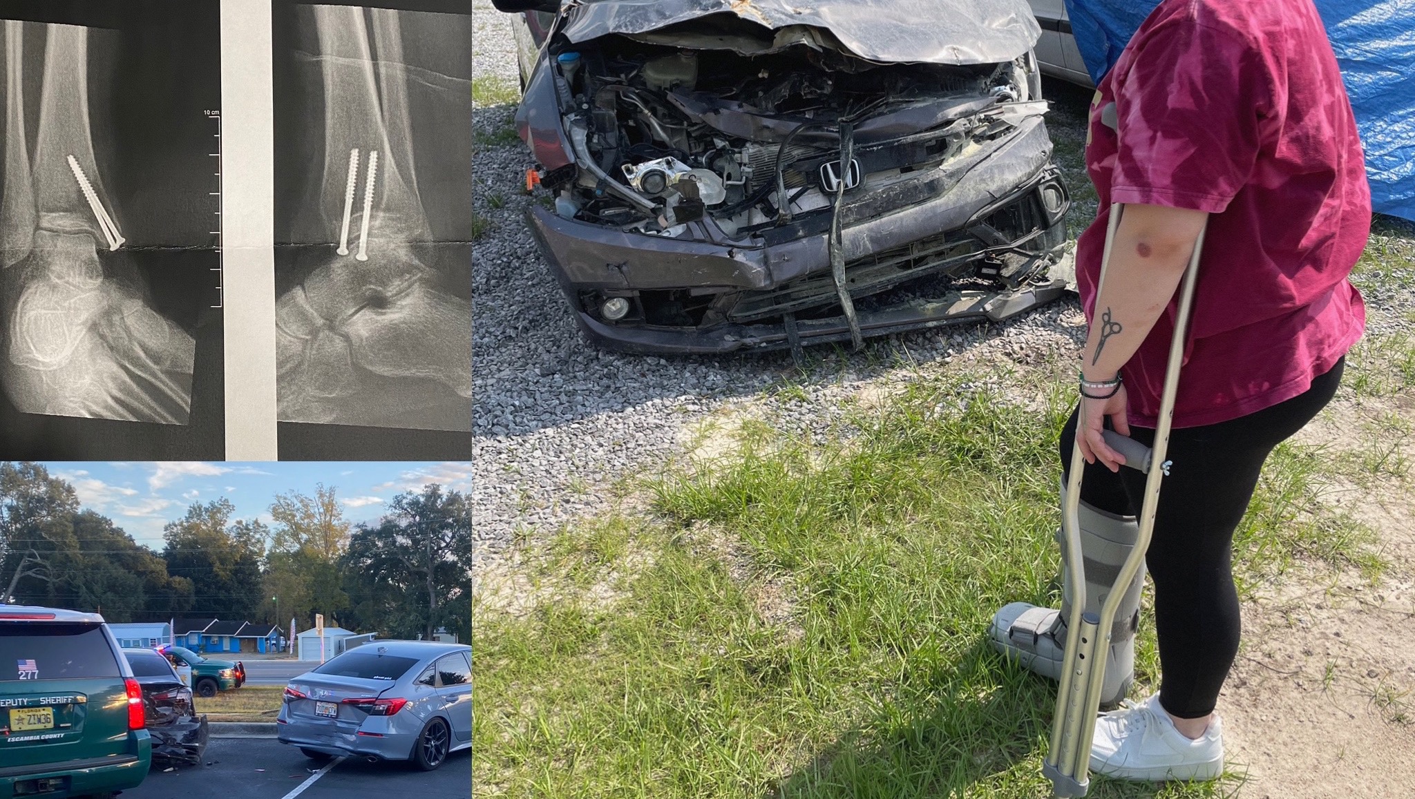 Fundraiser by Haley Echols : Help Haley Get Back on Her Feet