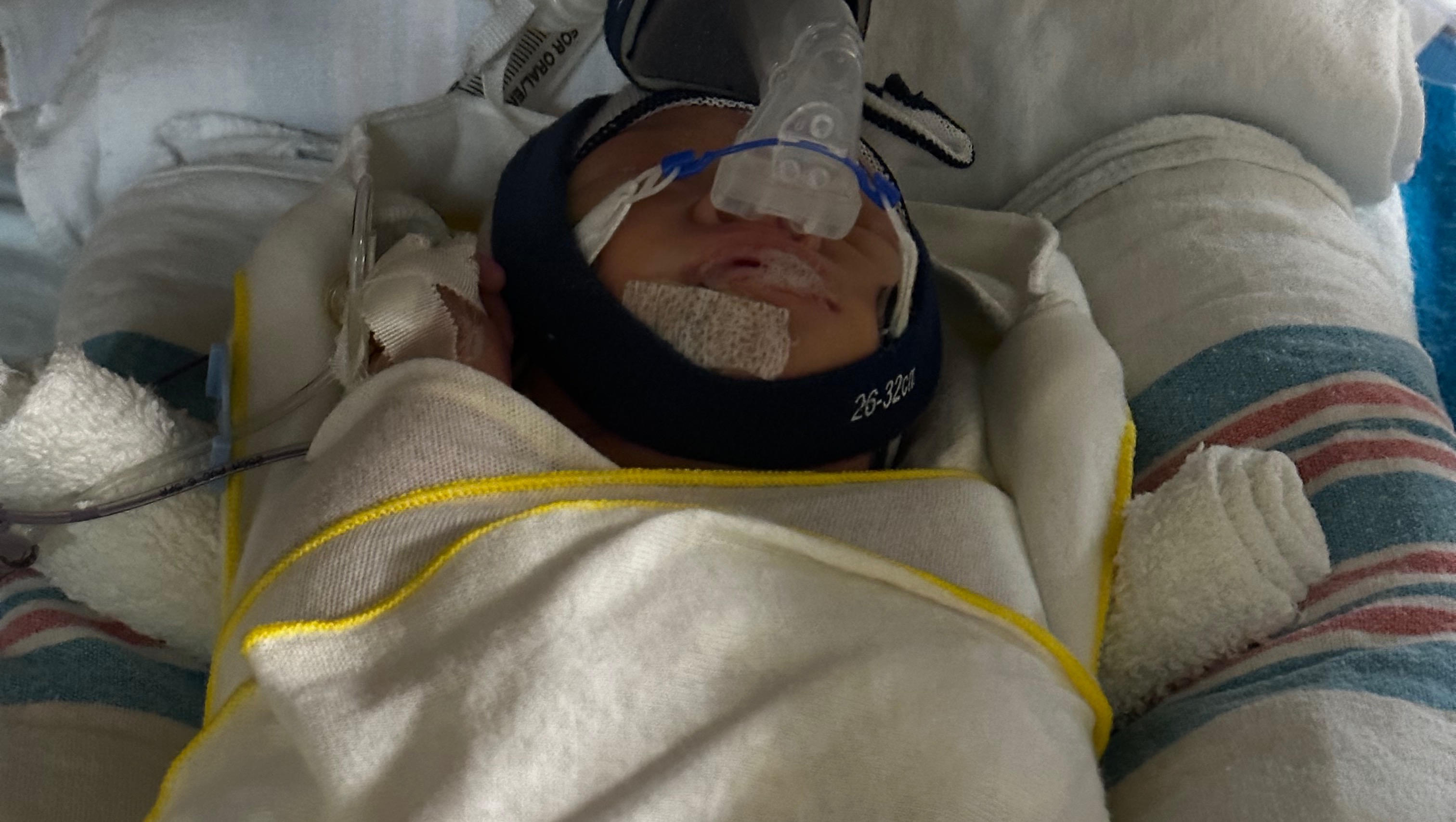 Fundraiser by Kyle Adair : Apollo’s Funeral Arrangements