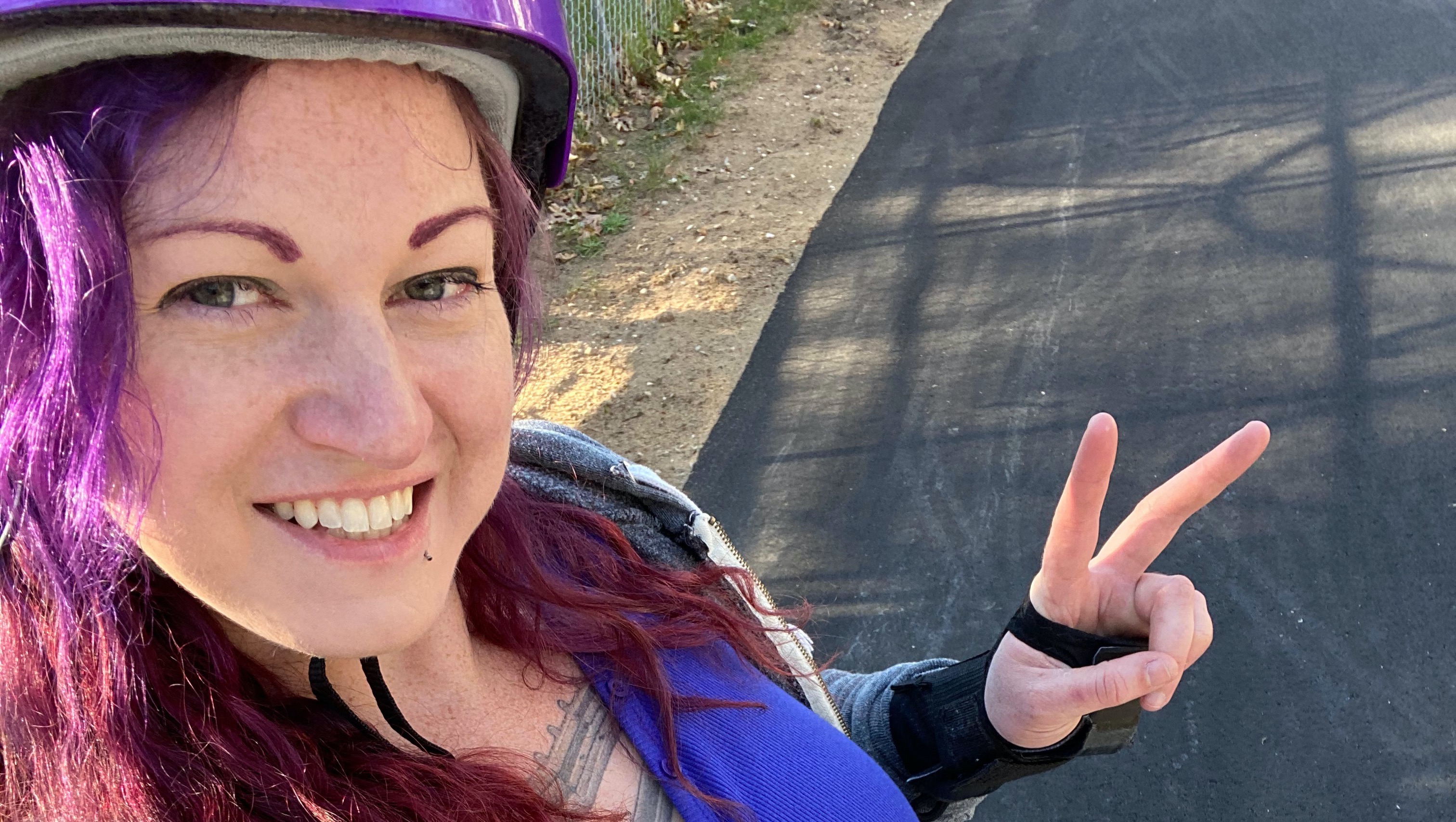 Fundraiser by Tara Hurlin : Help Tara get her smile back