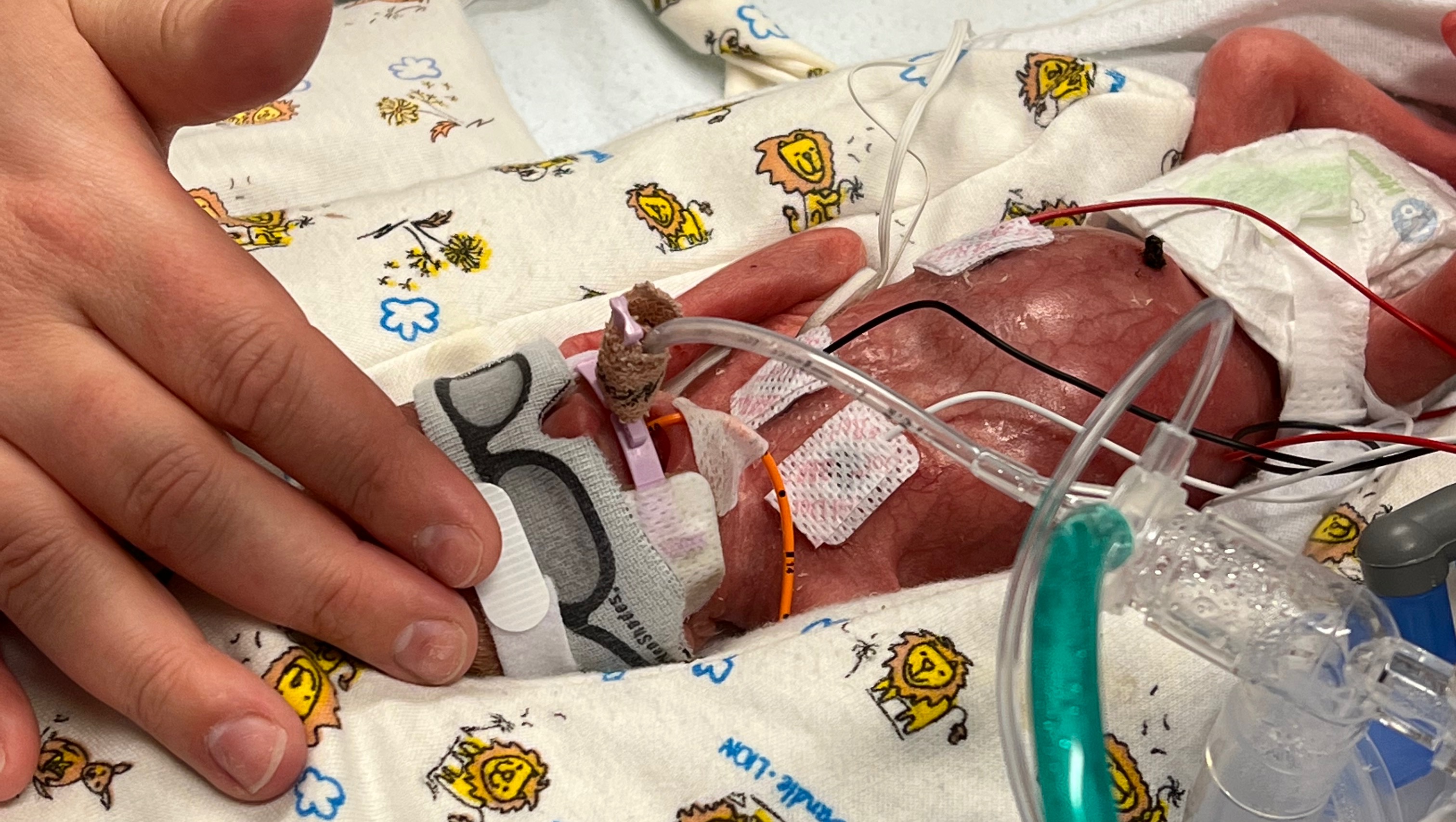 Fundraiser for Angela Campbell by Misty Edmunds : Mackenzie and her new ...