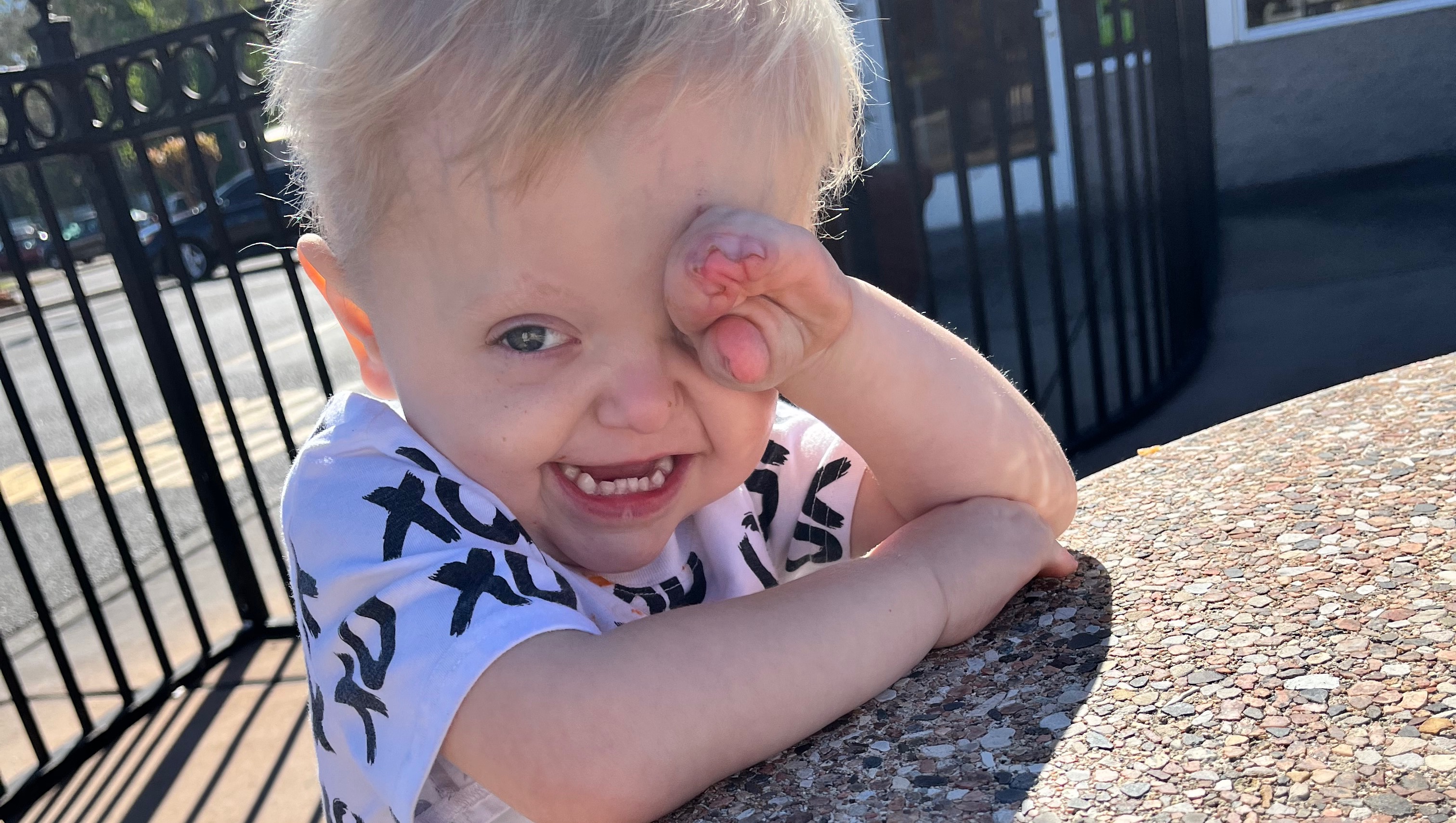Fundraiser by Sarah Cunningham : Help Alijah find his 10 fingers and 10 ...