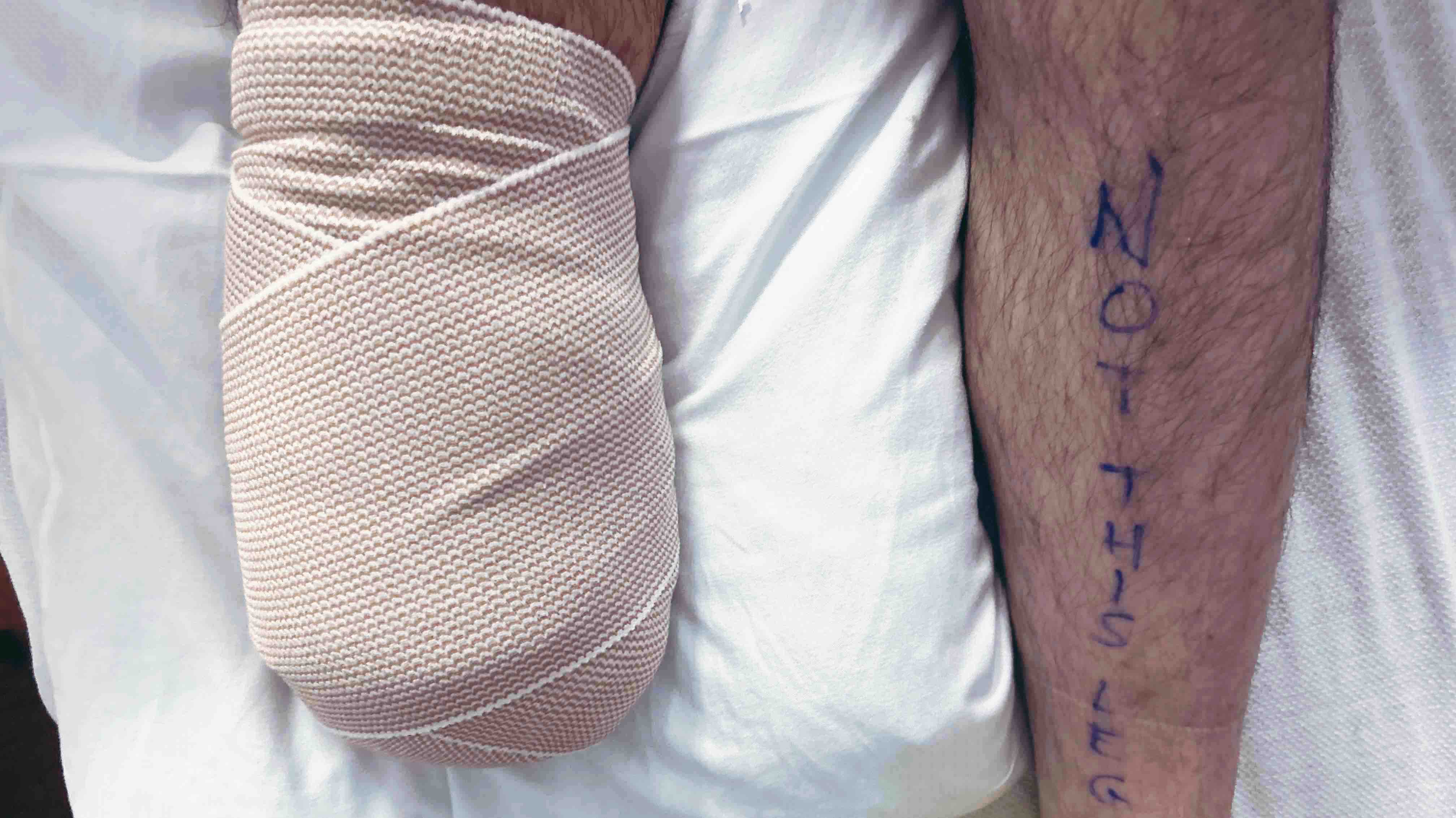 Fundraiser by Christopher Myers : Help with expenses after losing my leg