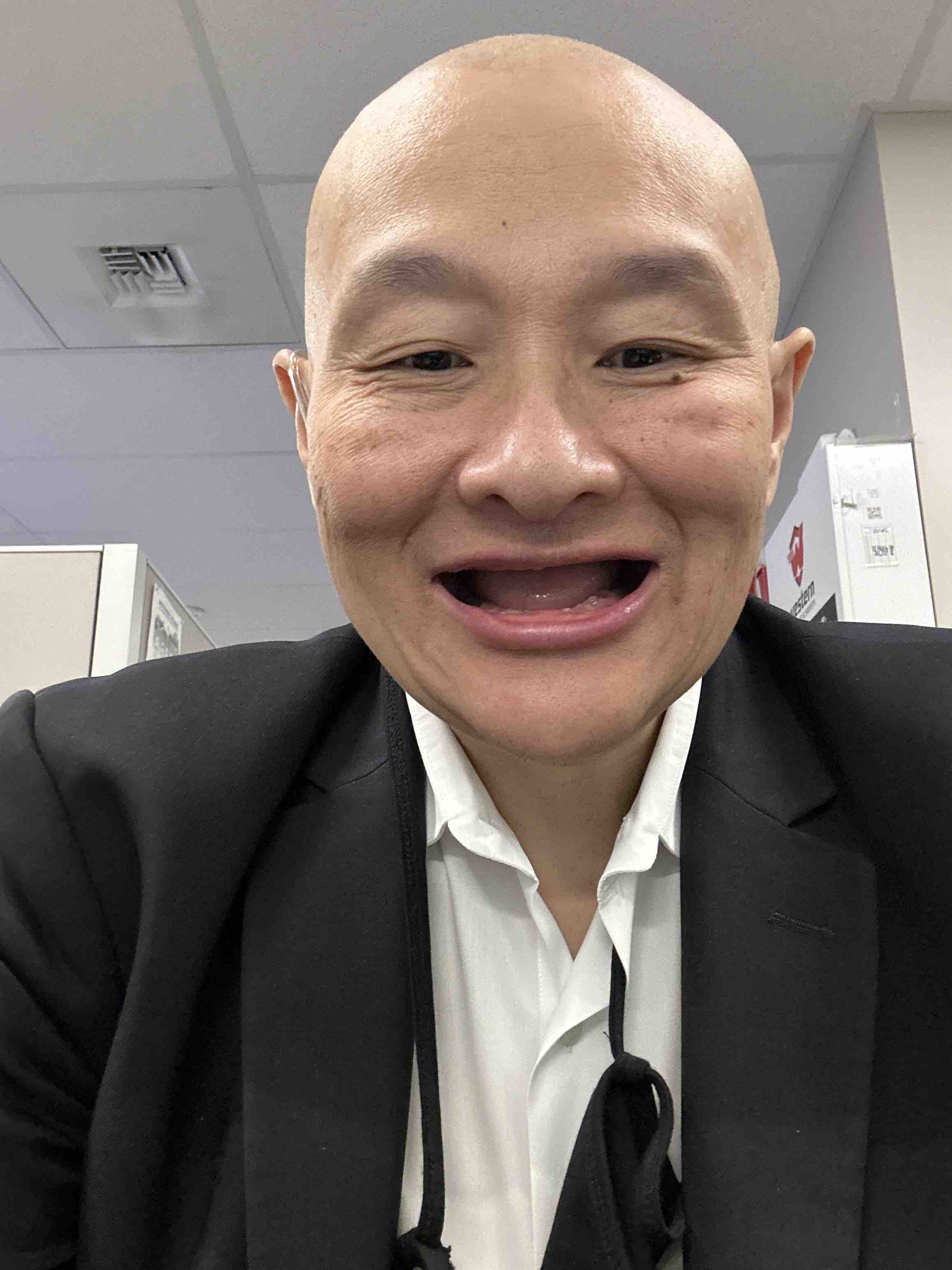 Fundraiser by Alvin Loh : Bring my SMILE back!!