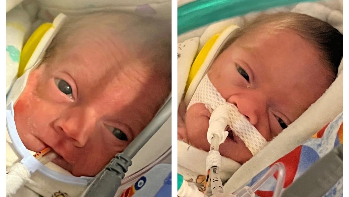 Fundraiser for Ashley Pauline by Megan Dever : The Pauline Twins ...