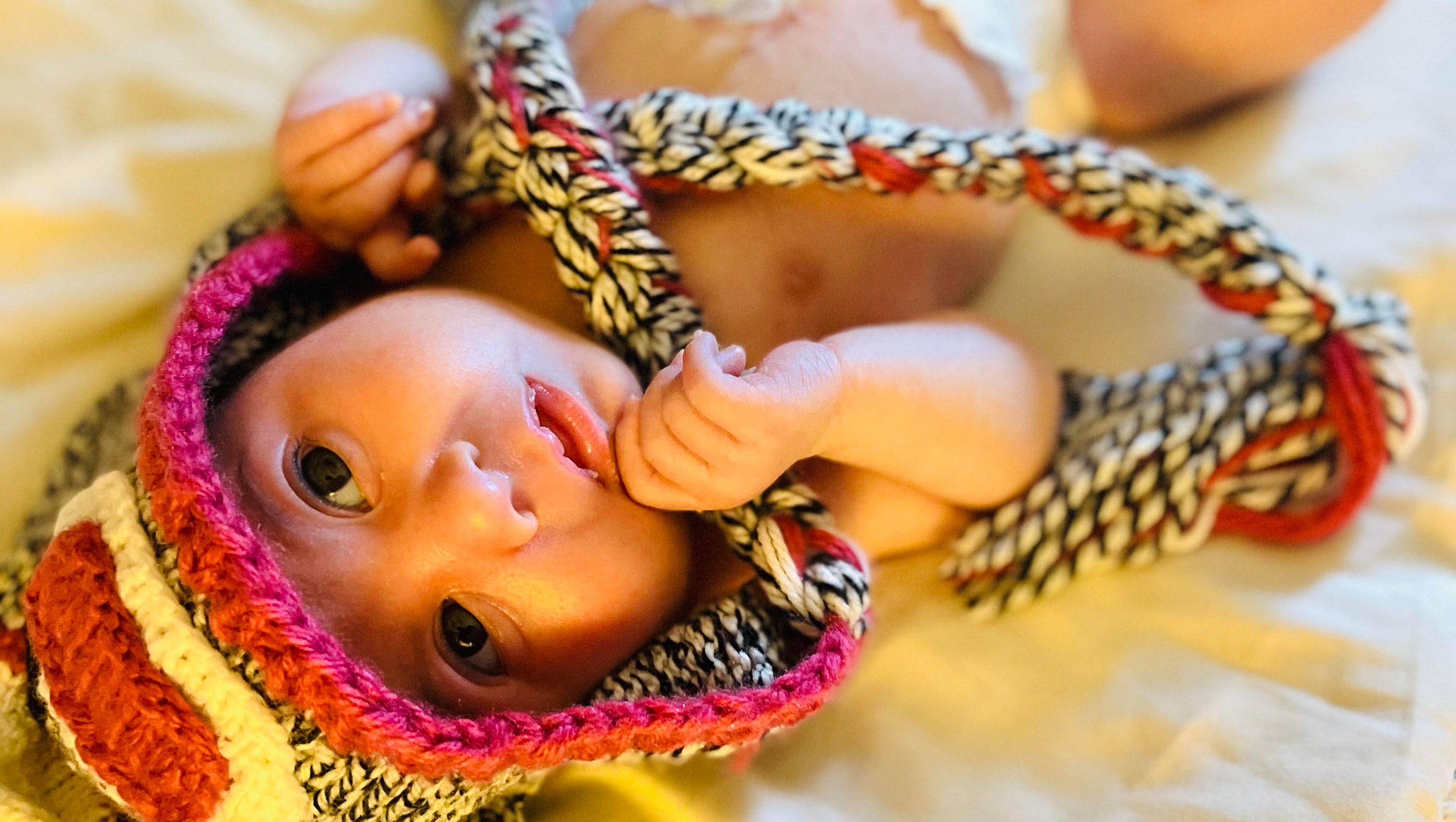 Fundraiser for Robert Clasen by Eric Turney : The Miracle that was ...