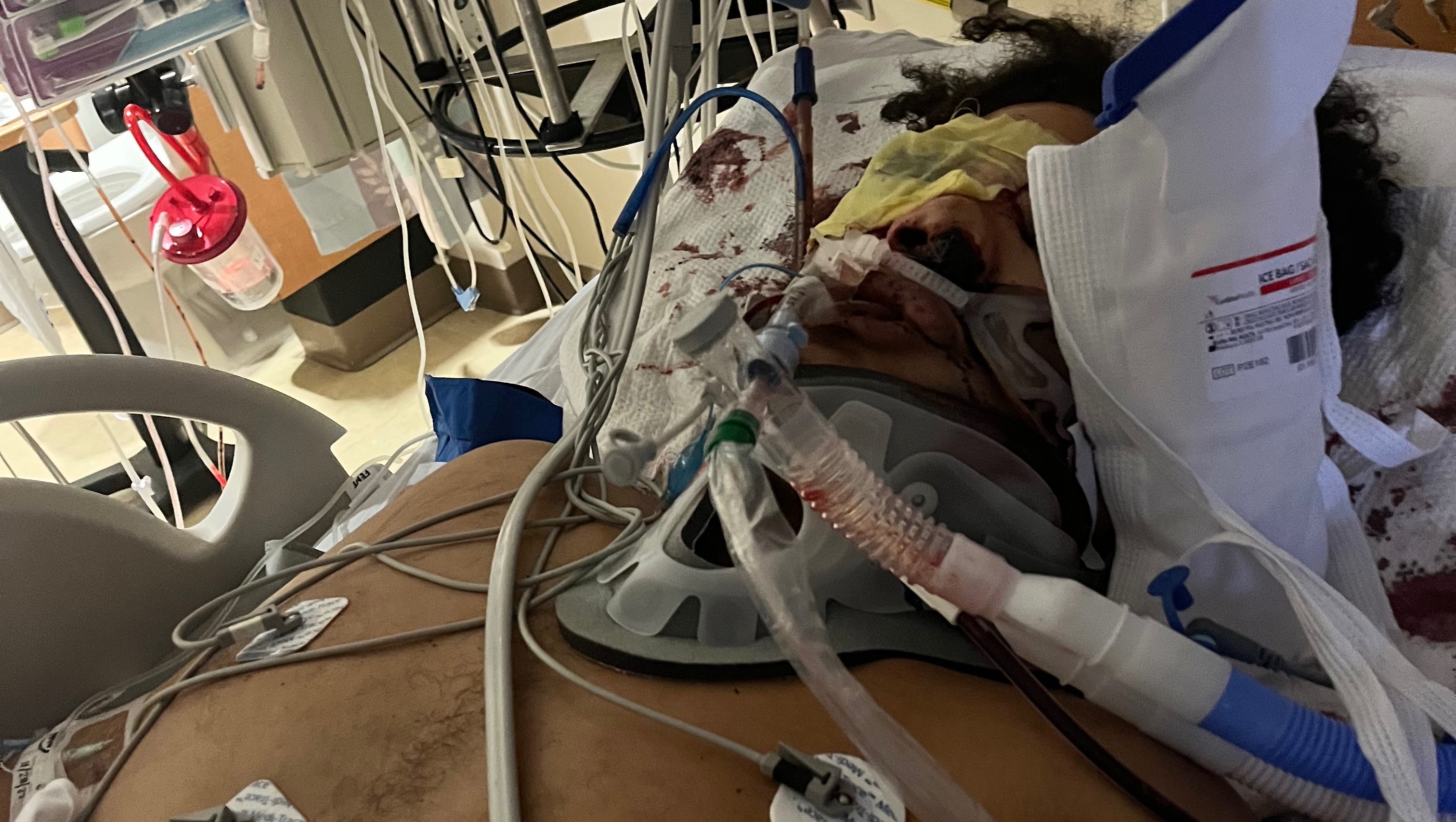 Fundraiser by Michelle Buker : Damien "Peanut” Lewis