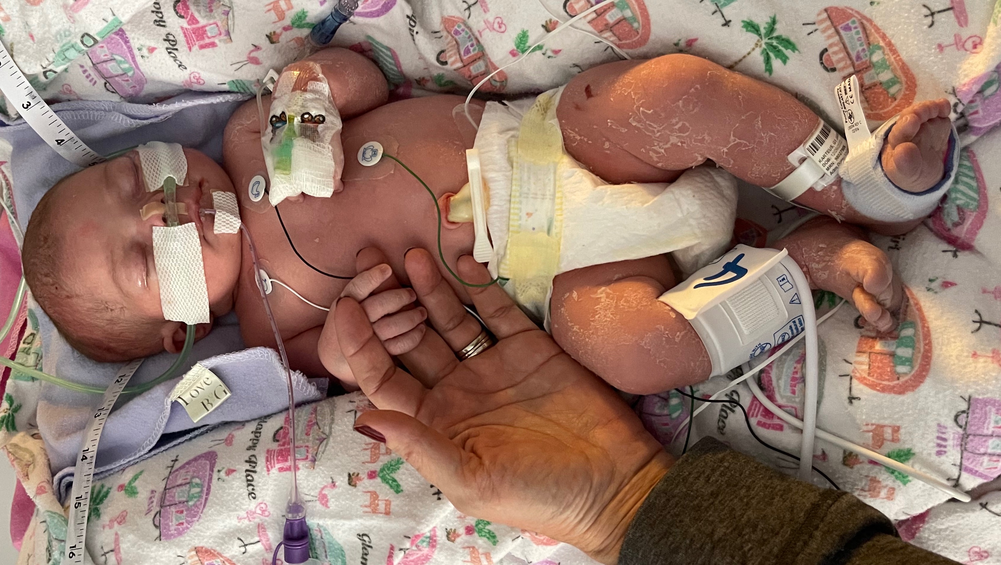 Fundraiser by Ashley Forrester : Baby Genesis’s Medical Expenses