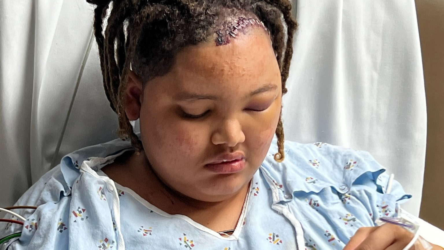Fundraiser by Isabella Wells : Long road to recovery