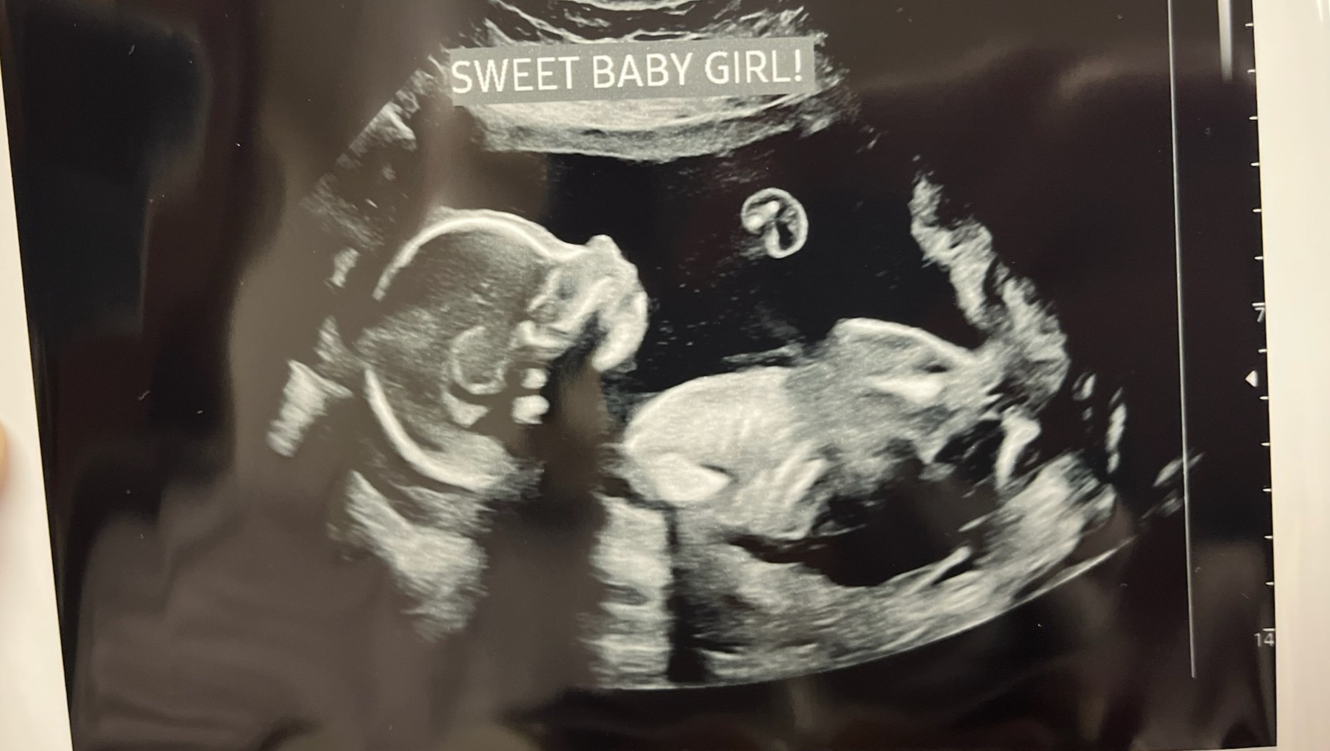 Fundraiser by Alison Downing : Remembering baby girl Peyton