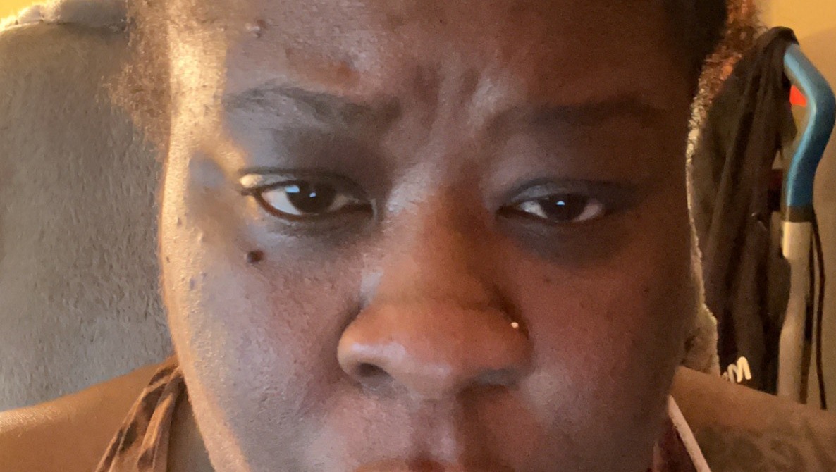 Fundraiser by KENNETH VALENTINE : Please to help with Shea's medical