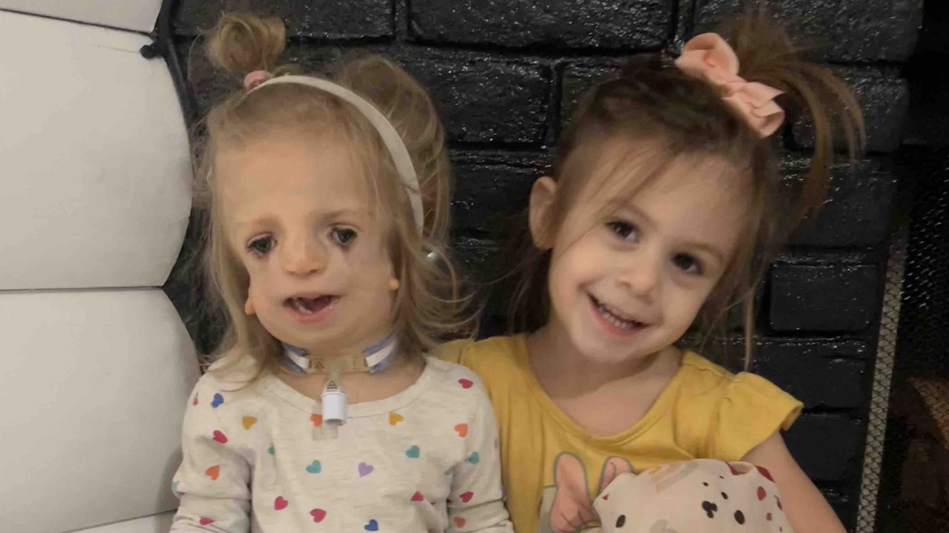 Fundraiser by Lorin Messer : Finlee June’s Journey: Treacher Collins ...