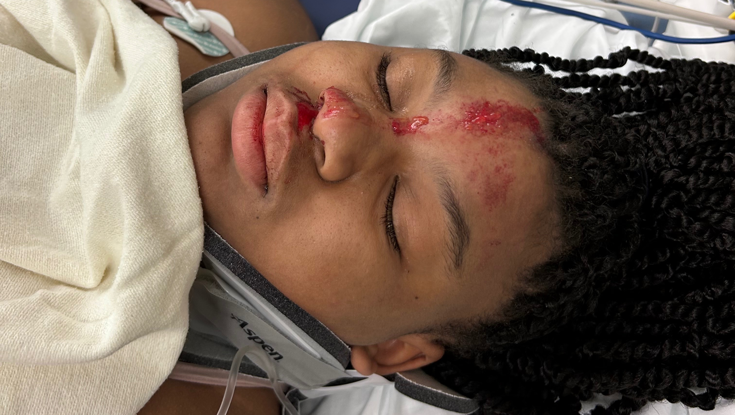 Fundraiser for Monik Beene by Trinity Weston-willis : Sa’maya medical bills