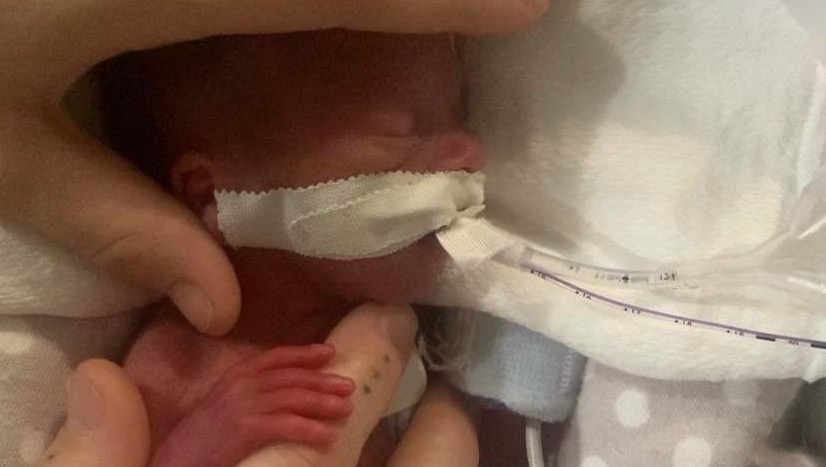 Fundraiser for Amelia Morlan by Teresa Greniger : Help for Amelia ...