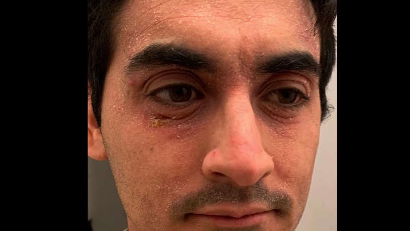 Fundraiser by Alex Calzada : Help support us through Alex’s healing