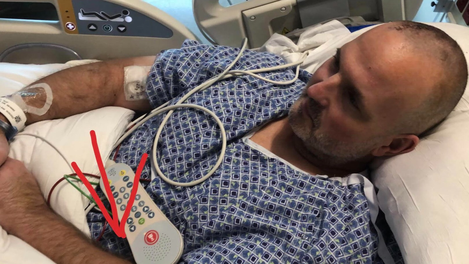 Fundraiser by Nicolas Powell : Please Help my Father Scott Kopko ...