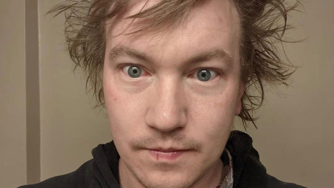 Fundraiser for Charles Samuelson by Chris Porter : Help Charles not be dead