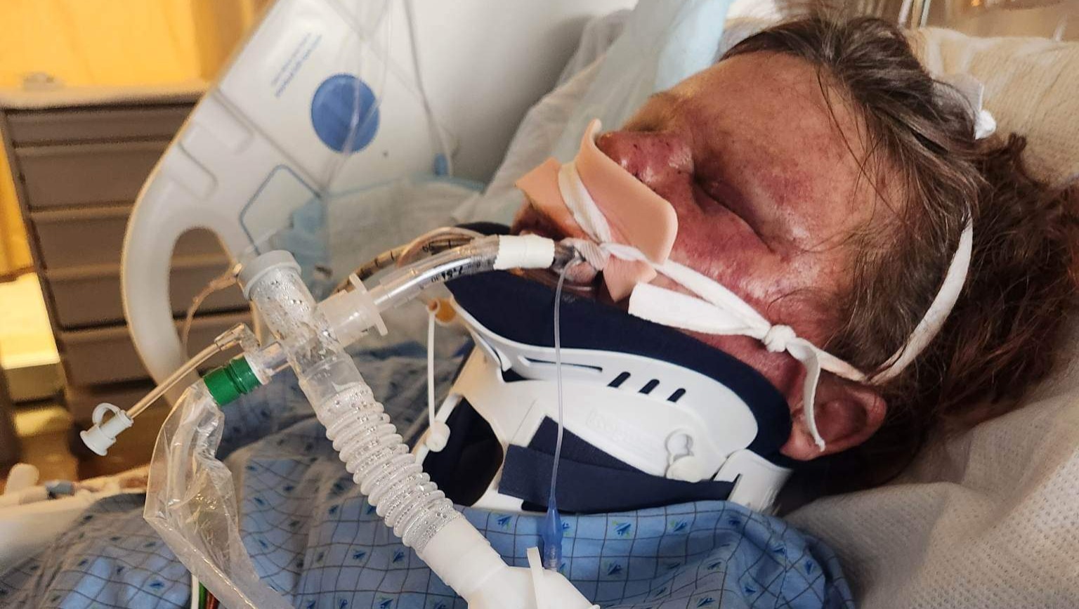 Fundraiser for Josey Wesley by Jordan Brown : Becky Burress' Recovery ...