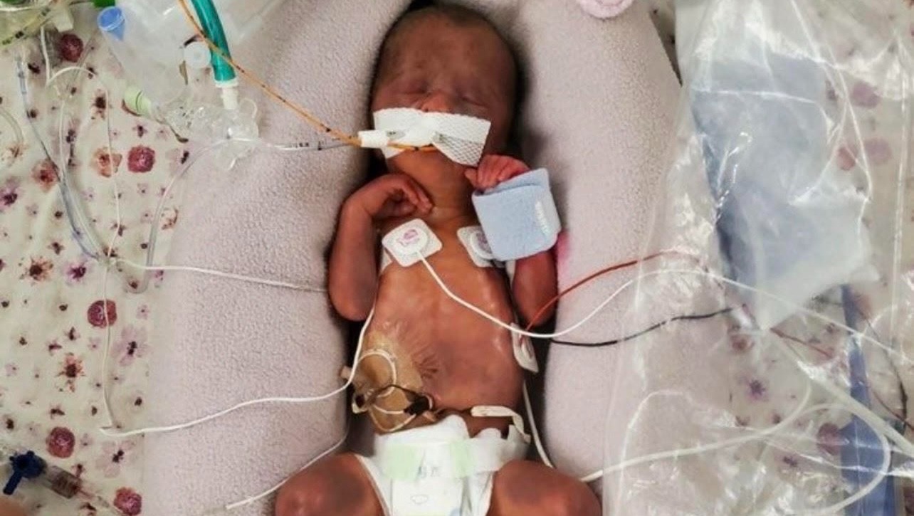 Fundraiser for Hannah Rindels by Brittany Bendickson : Fraya Ann's Fight