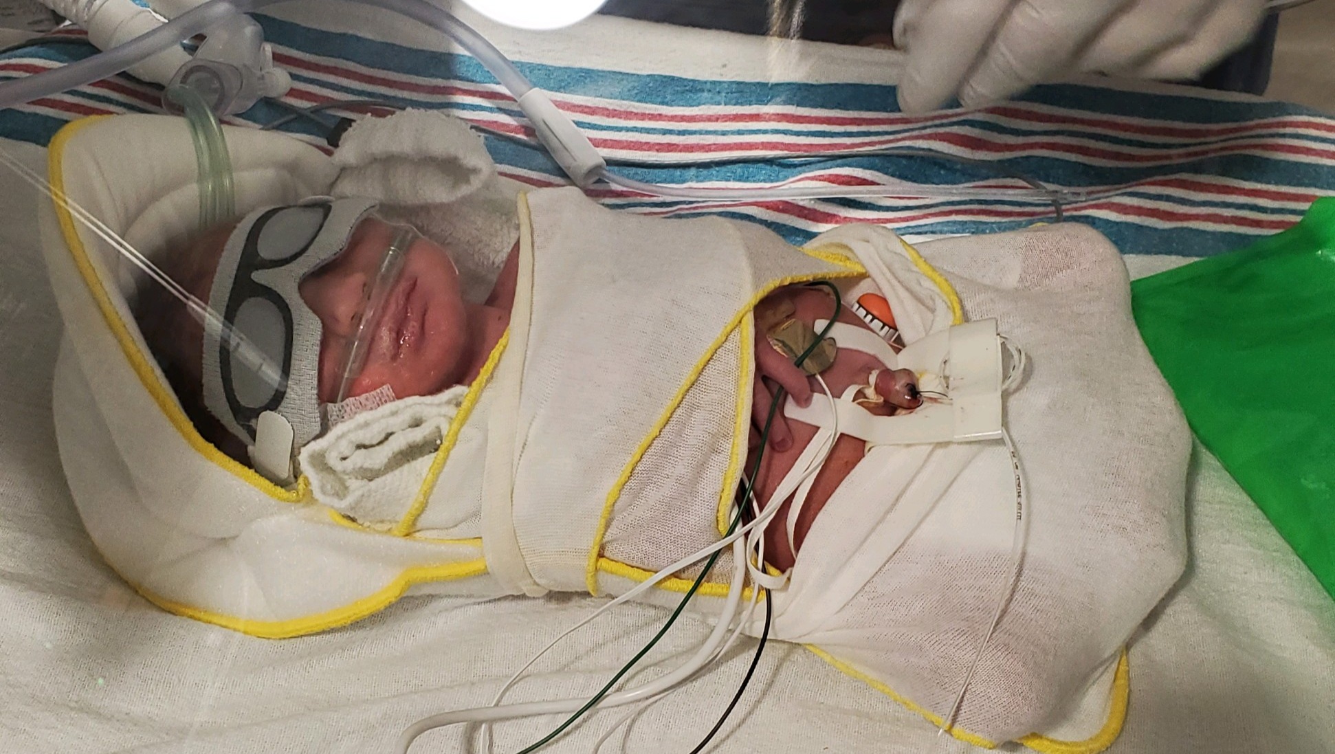 Fundraiser by Laura Strang : My little 29 weeker