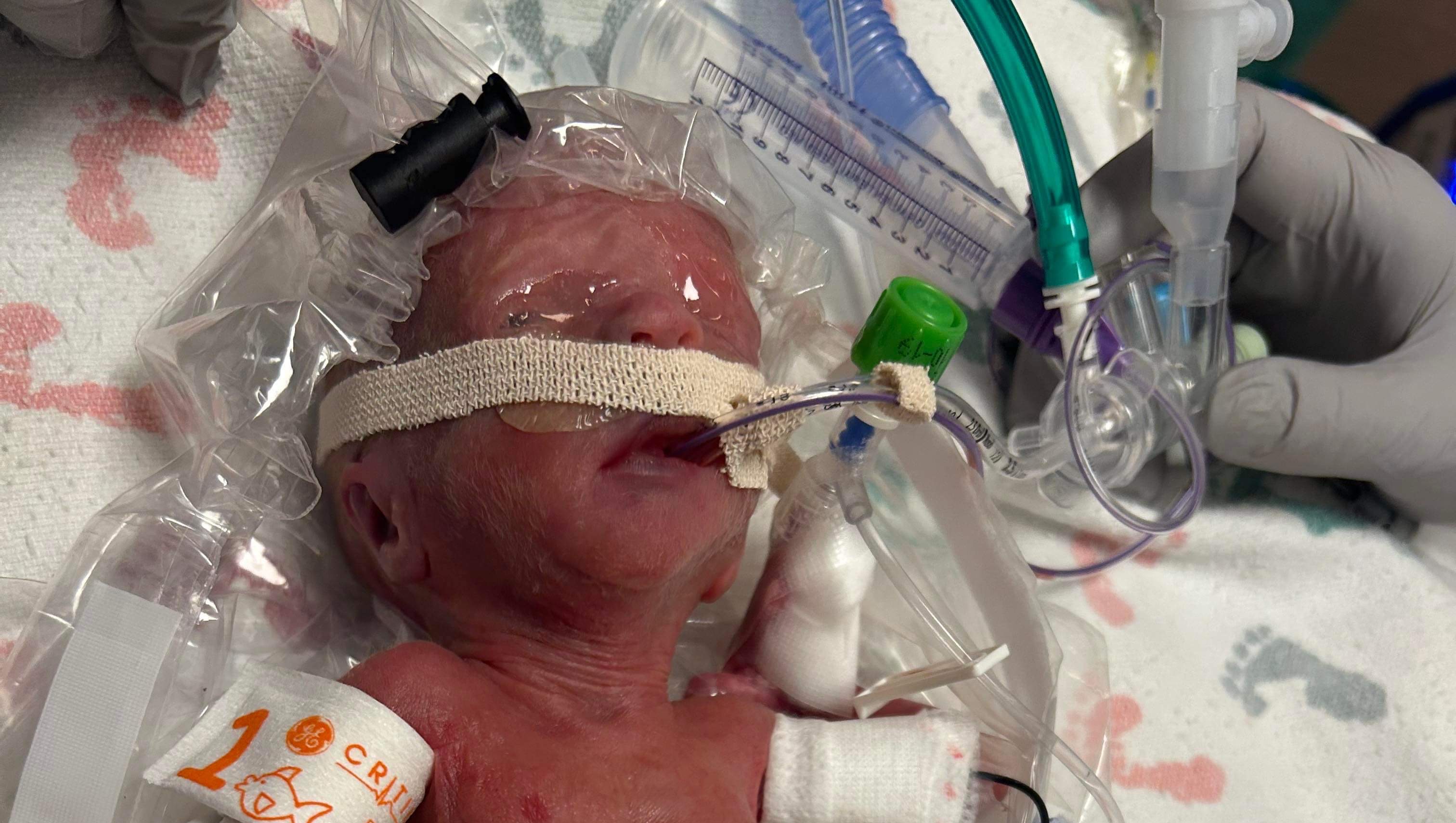 Fundraiser for Emberly Wadworth by Heather DeBuck : A small miraculous ...