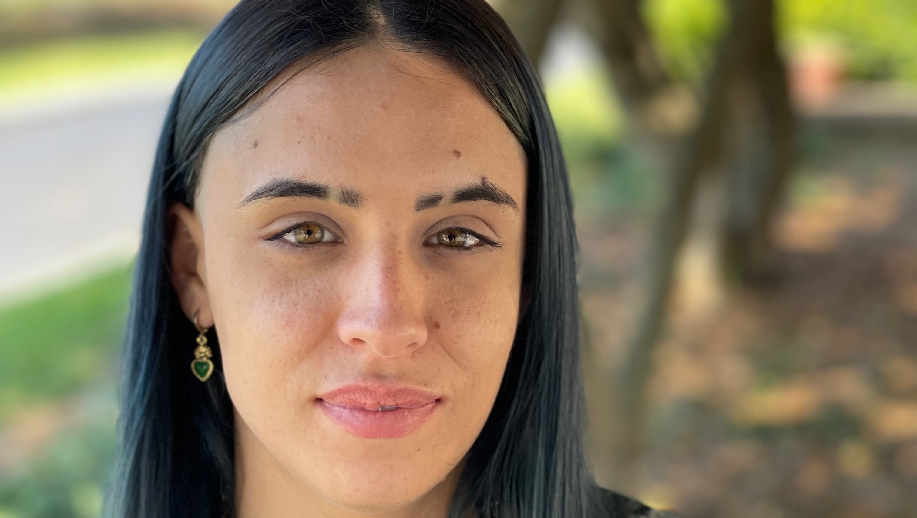 Fundraiser for Luigi La Rocca by Nicole Umbreit : Melanoma Cancer Eye ...