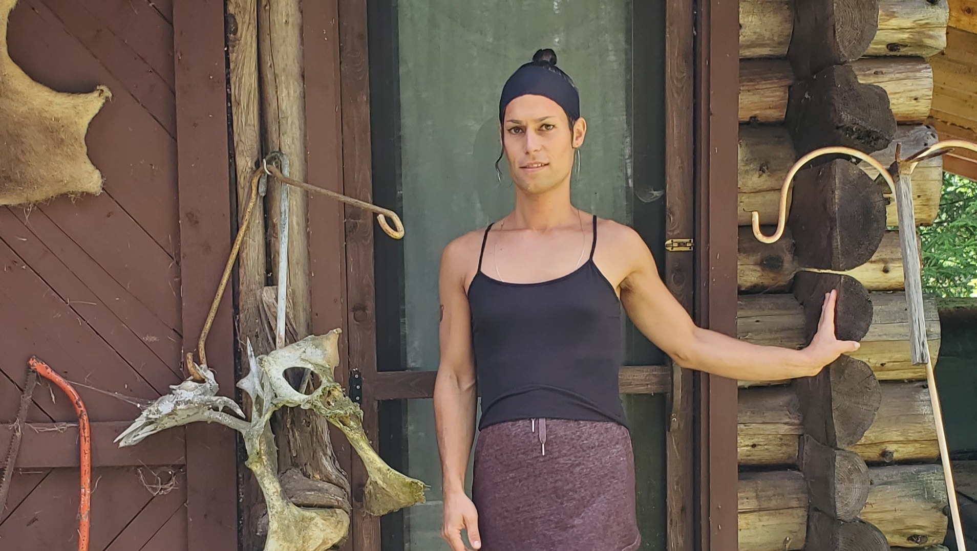 Fundraiser by Kylee Foster : Kylee's Facial Hair Removal Fund