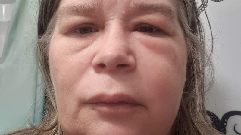 Fundraiser by Allyson Snow : Help my mom get her smile back!