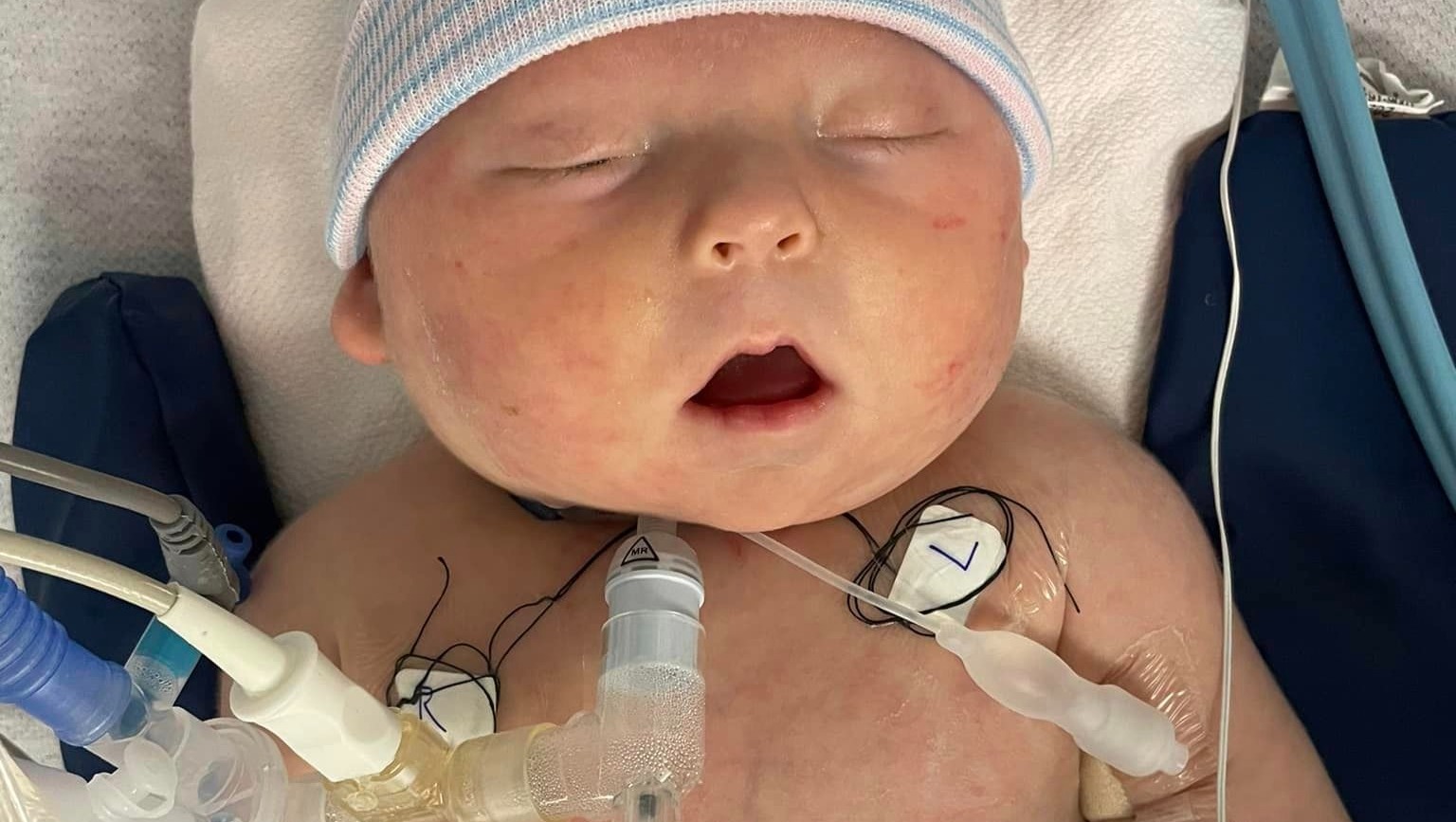 Fundraiser for Gail Egan by Catherine Hodge : Help for Baby Joshua and ...