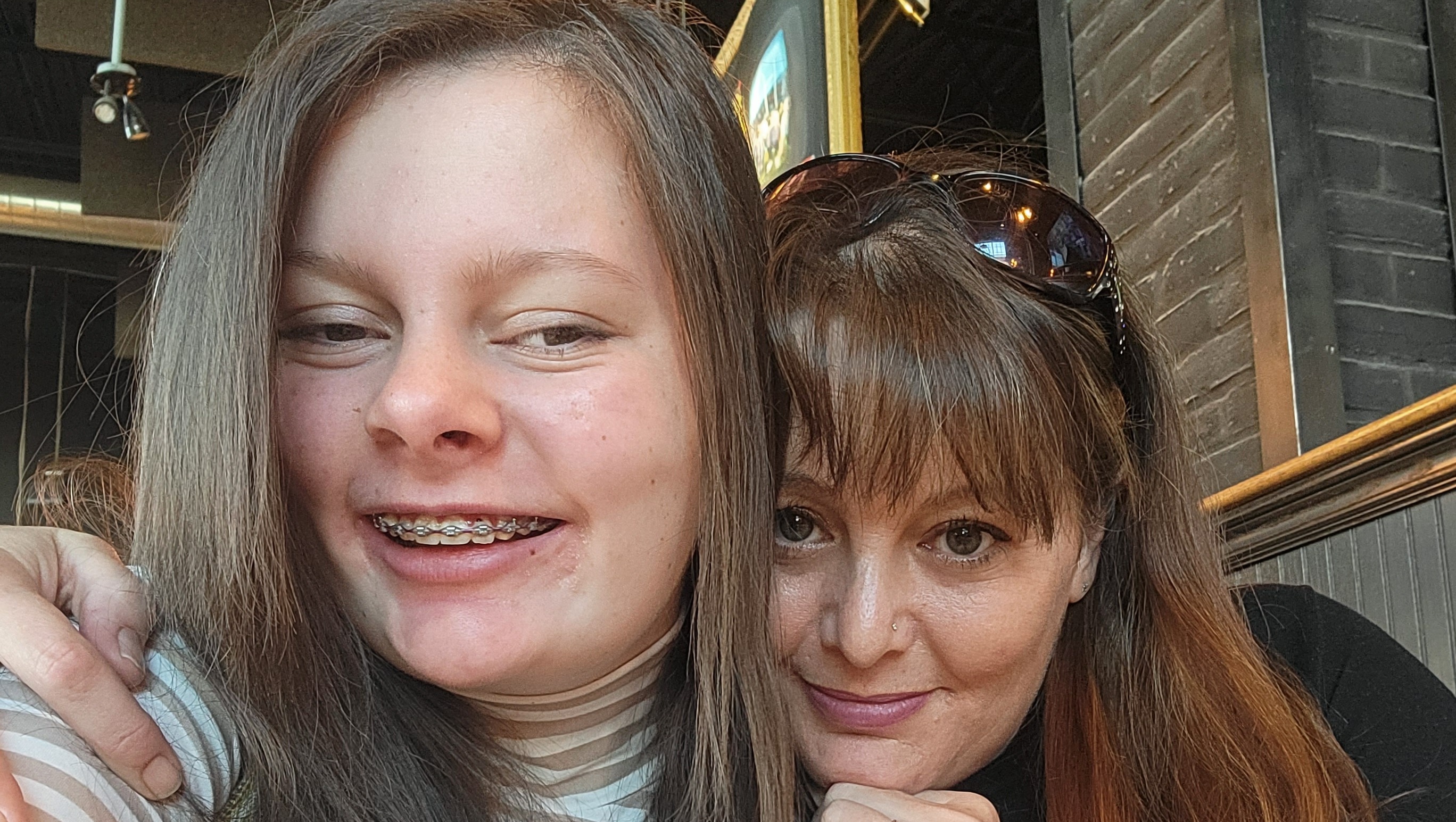 Fundraiser by Angelina Hartwig : Nicole's Jaw Surgery
