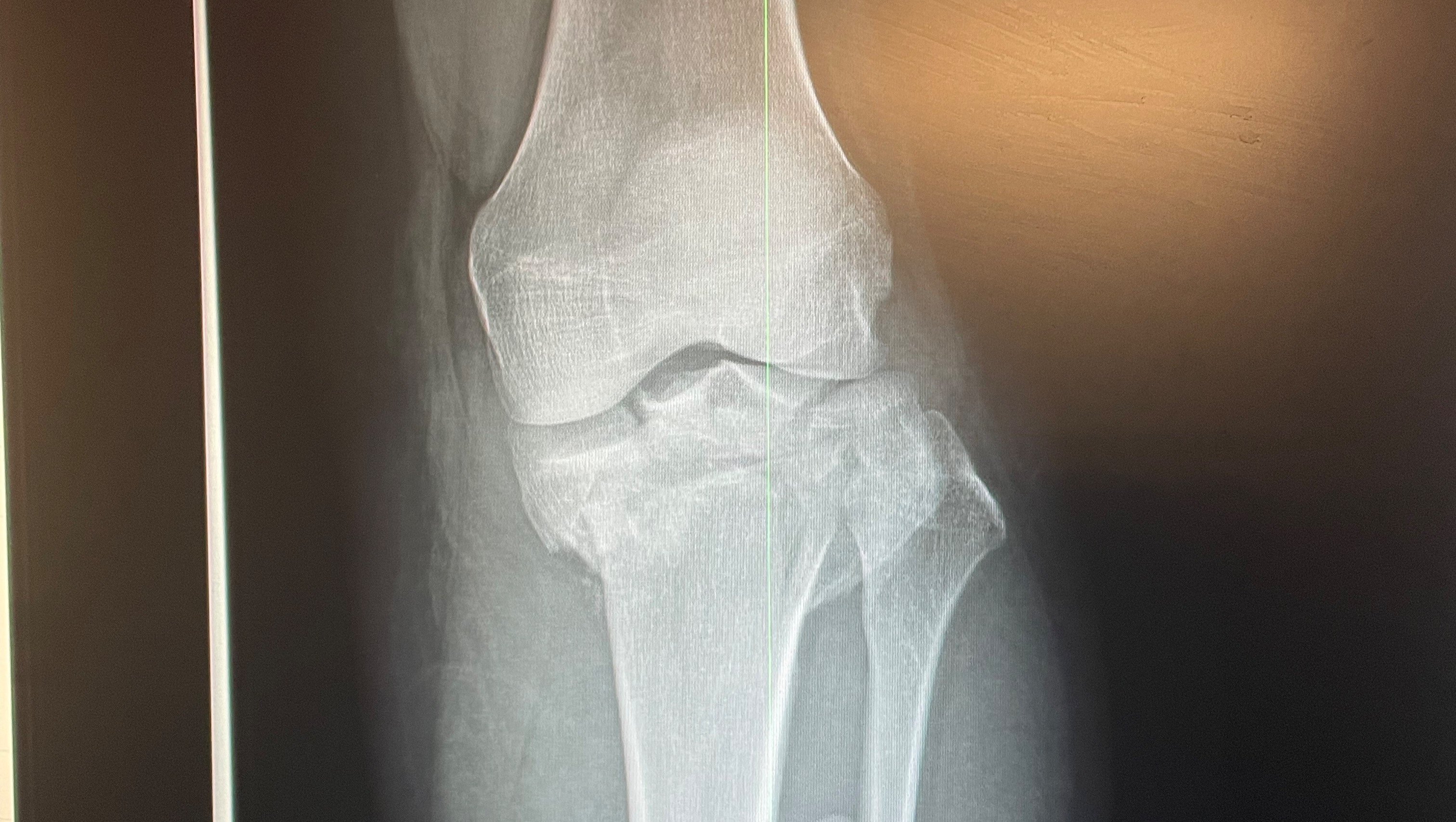 Fundraiser by Whitney McBride : Single Mom Needs Help to Graduate with ...