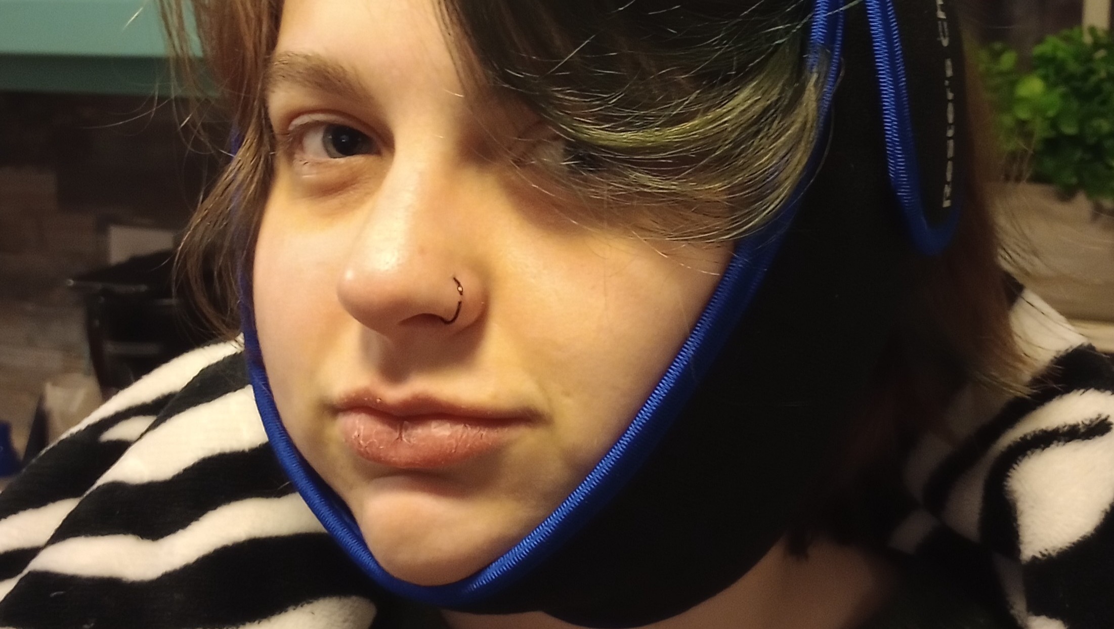 Fundraiser by Amanda Adams : Help Brooklyn get surgery