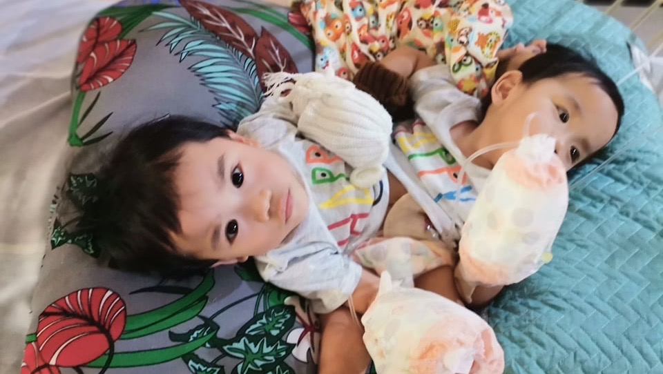 Fundraiser by Rachel Lundevall : Conjoined twins Chad and Alex Felipe