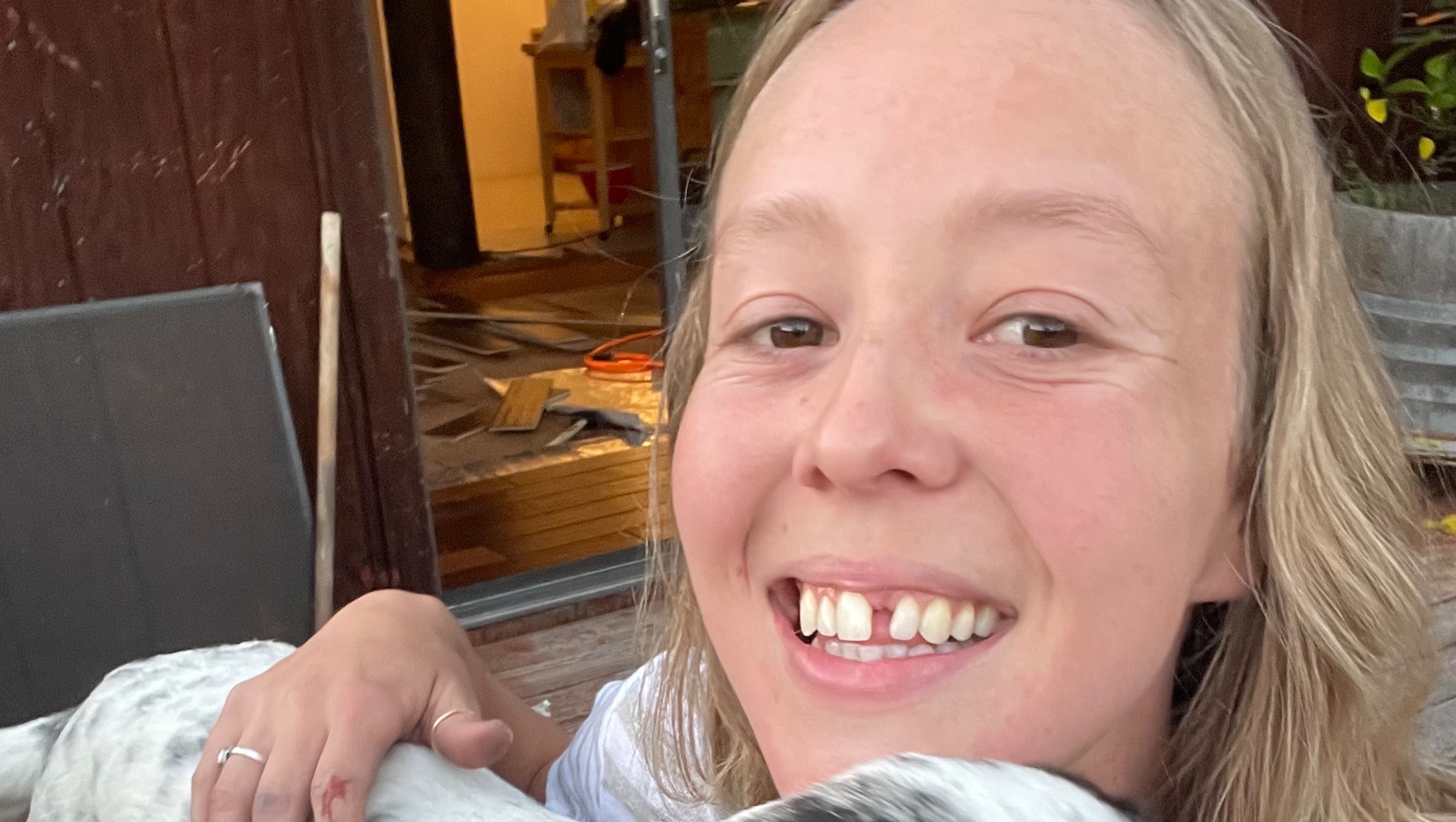 Fundraiser by Dalton Bunch : Help Lindsey get a tooth!