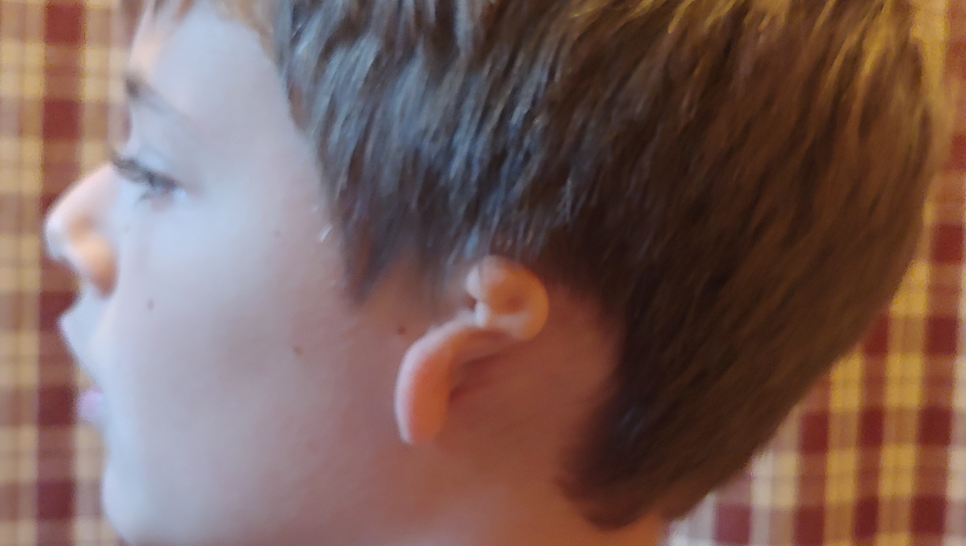 Fundraiser by Kathy Fleming : Help Chase hear and fix his ear.