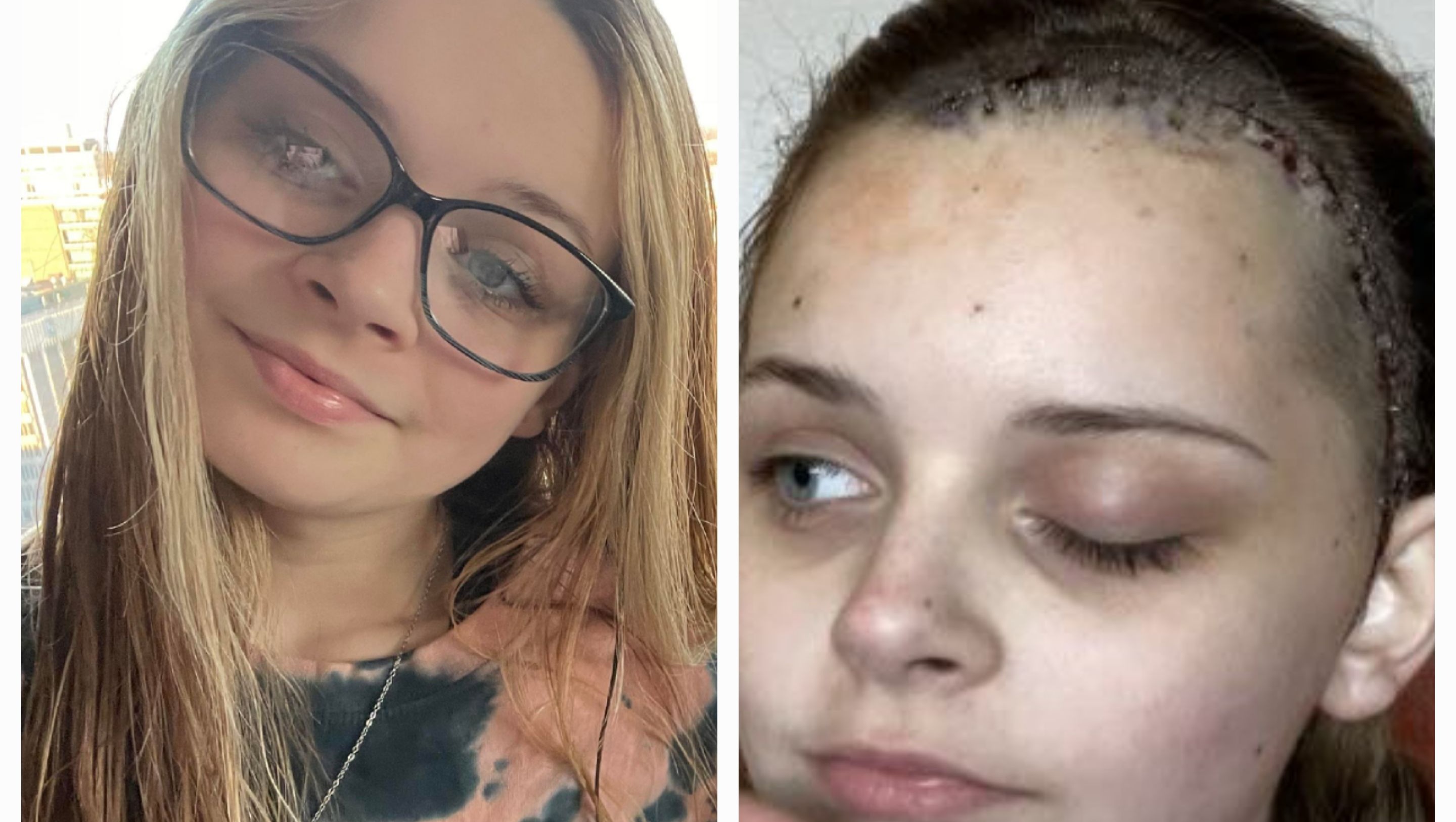 Fundraiser for Amanda Franklin by Megan Hansen : Help Brie beat cancer ...