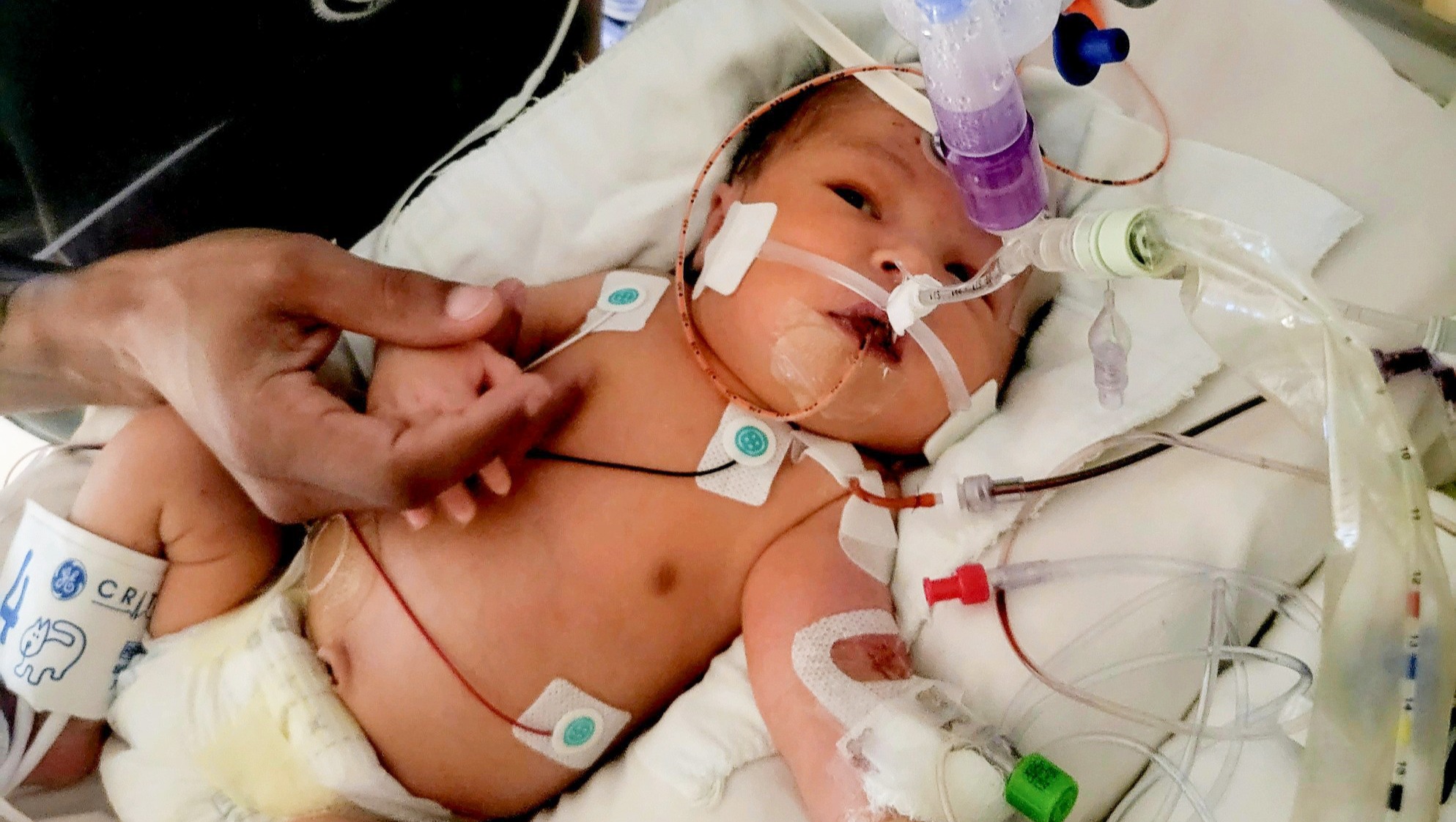 Fundraiser for Grace Stubblefield by Emily Martony : Jett Stubblefield NICU