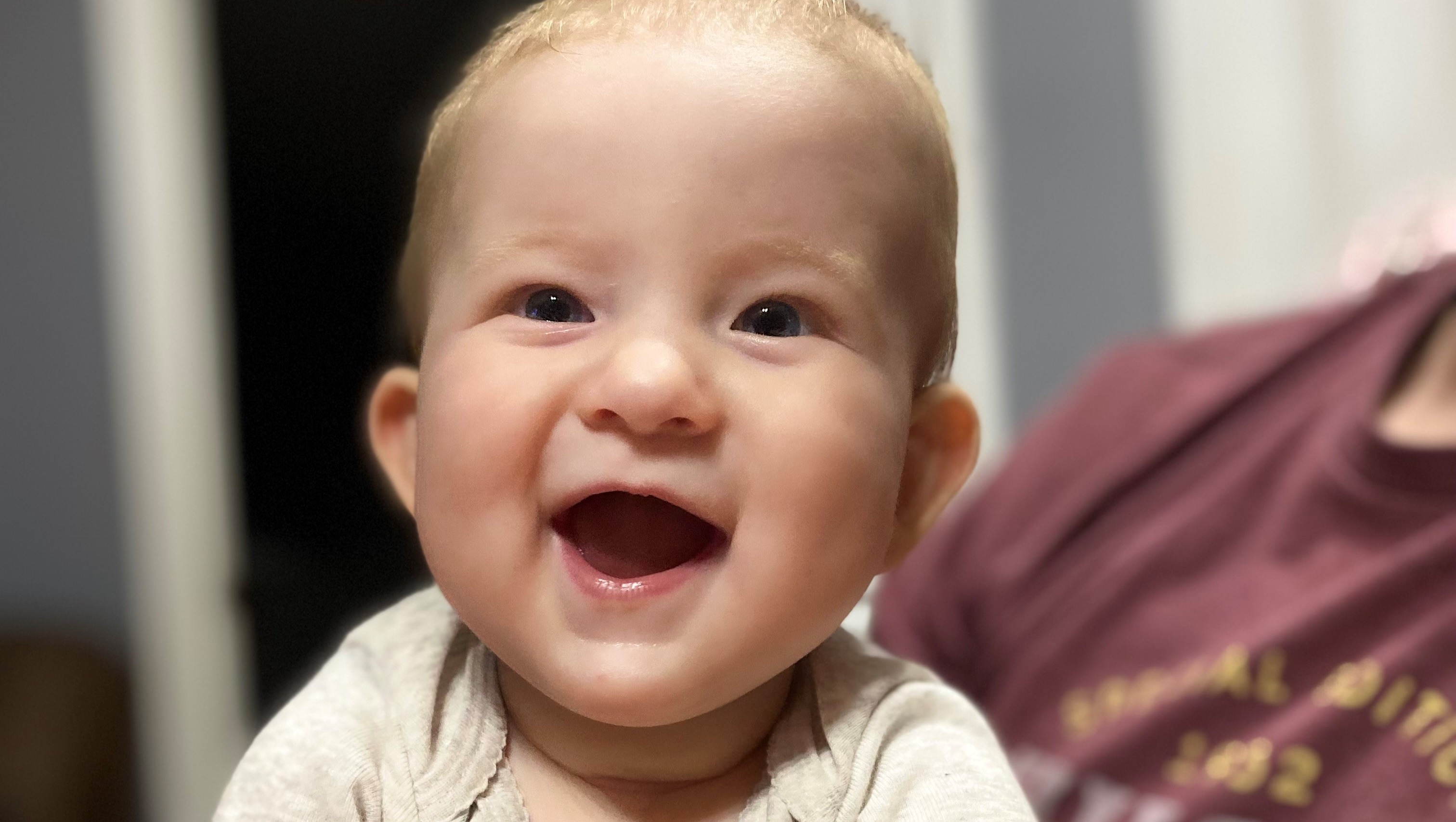 Fundraiser by KYLE RUNYON : Cranial Helmet for Baby Avery