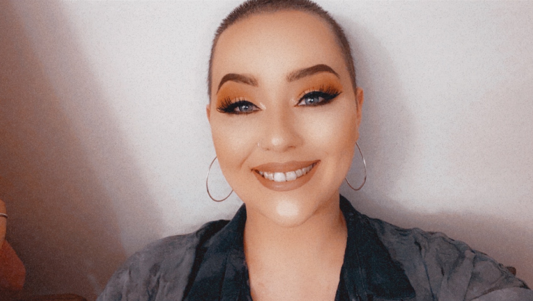 Fundraiser by Bobbie Phillips : Save Bobbie’s Smile