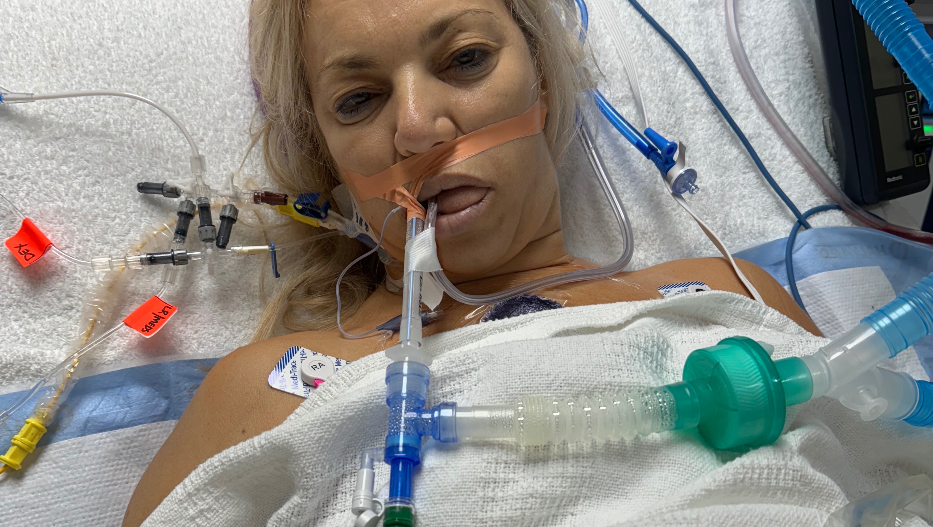 Fundraiser by Carol Paredes : Open heart surgery